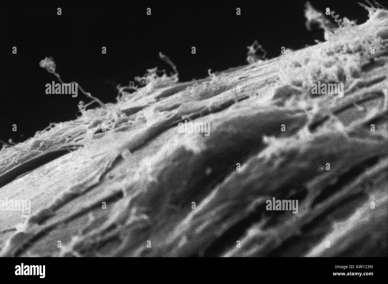 Electron micrograph of Treponema pallidum on cultures of cotton-tail ...