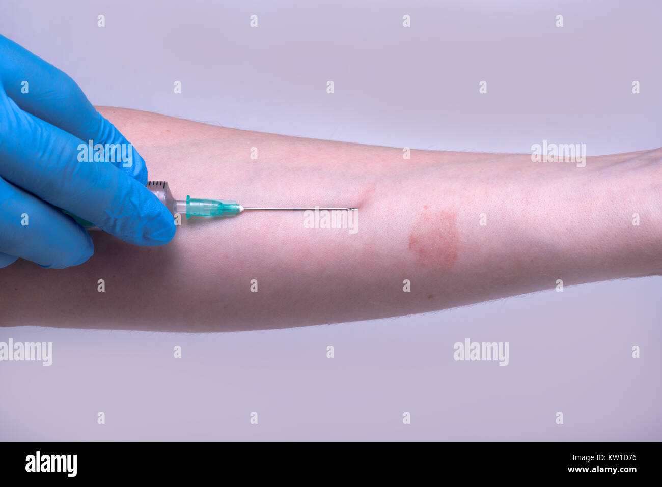 The doctor makes the patient an injection in the arm Stock Photo - Alamy