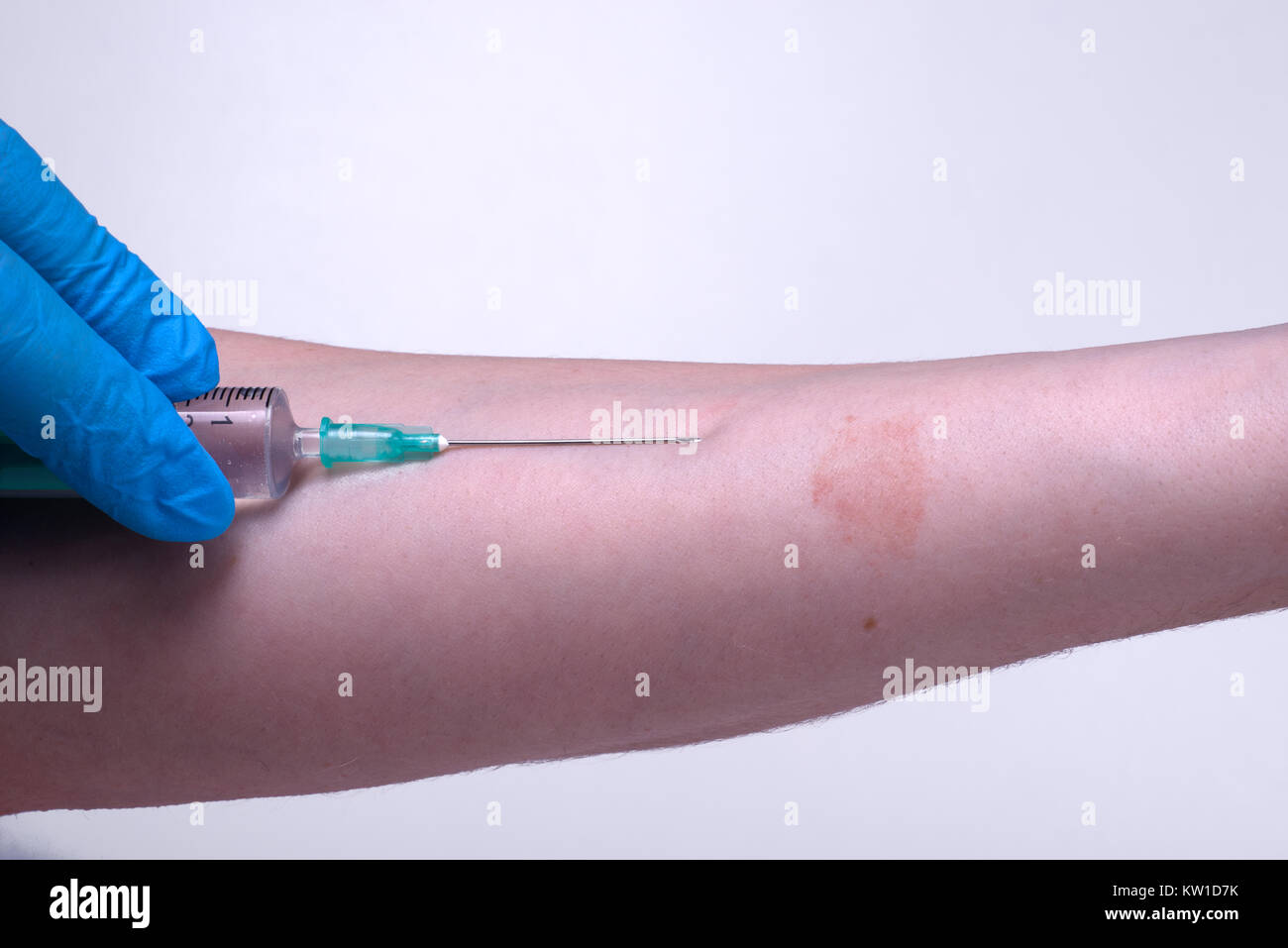 The doctor makes the patient an injection in the arm Stock Photo - Alamy