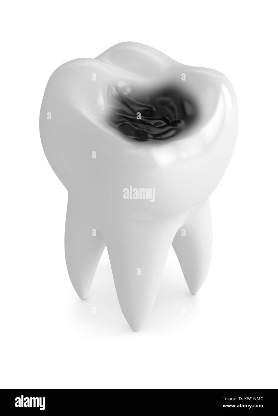 3d render of tooth with decay isolated over white background Stock ...