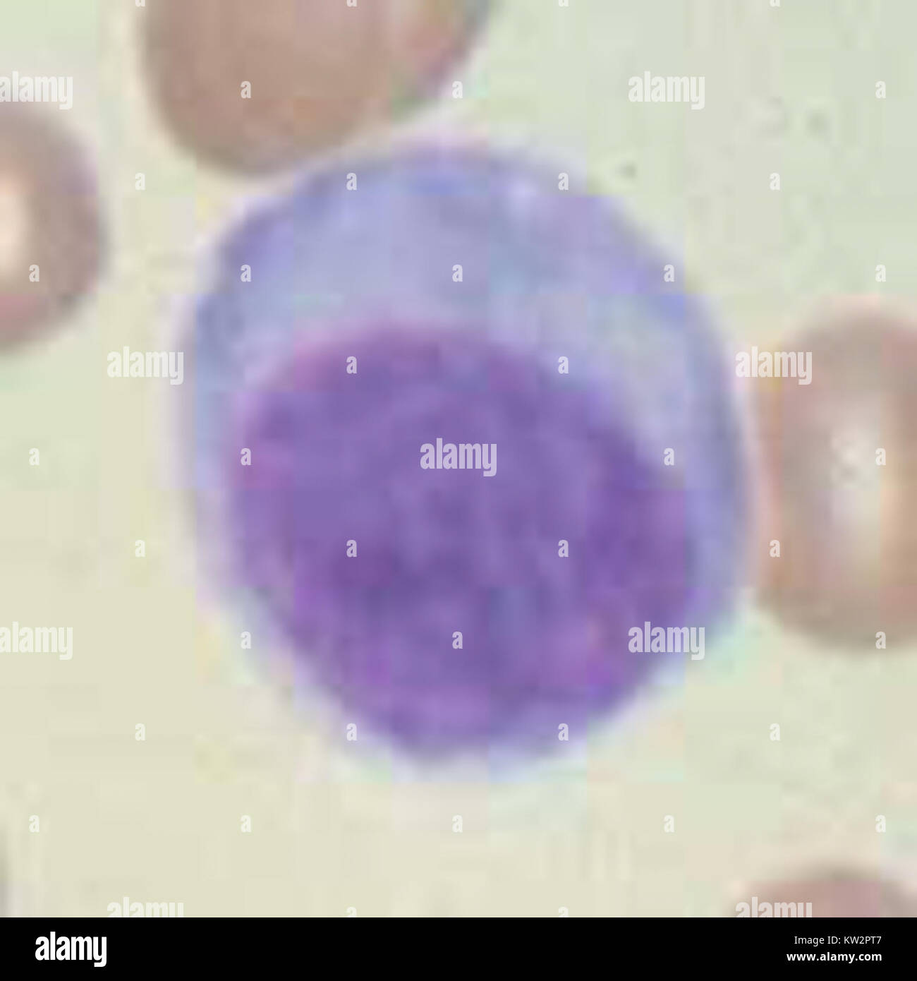 Plasmacells hi-res stock photography and images - Alamy