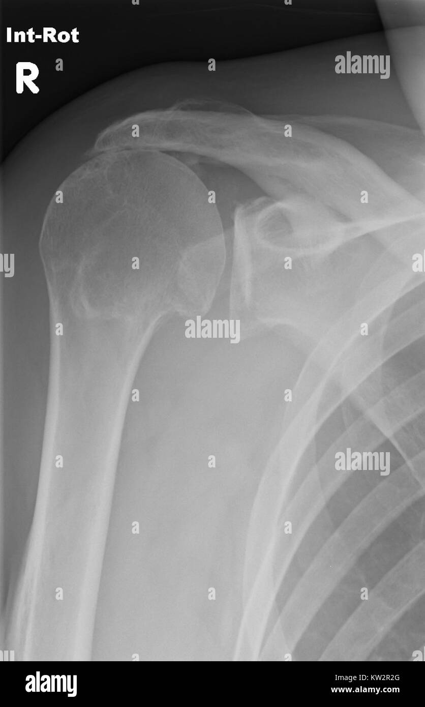 Book x ray Black and White Stock Photos & Images - Alamy