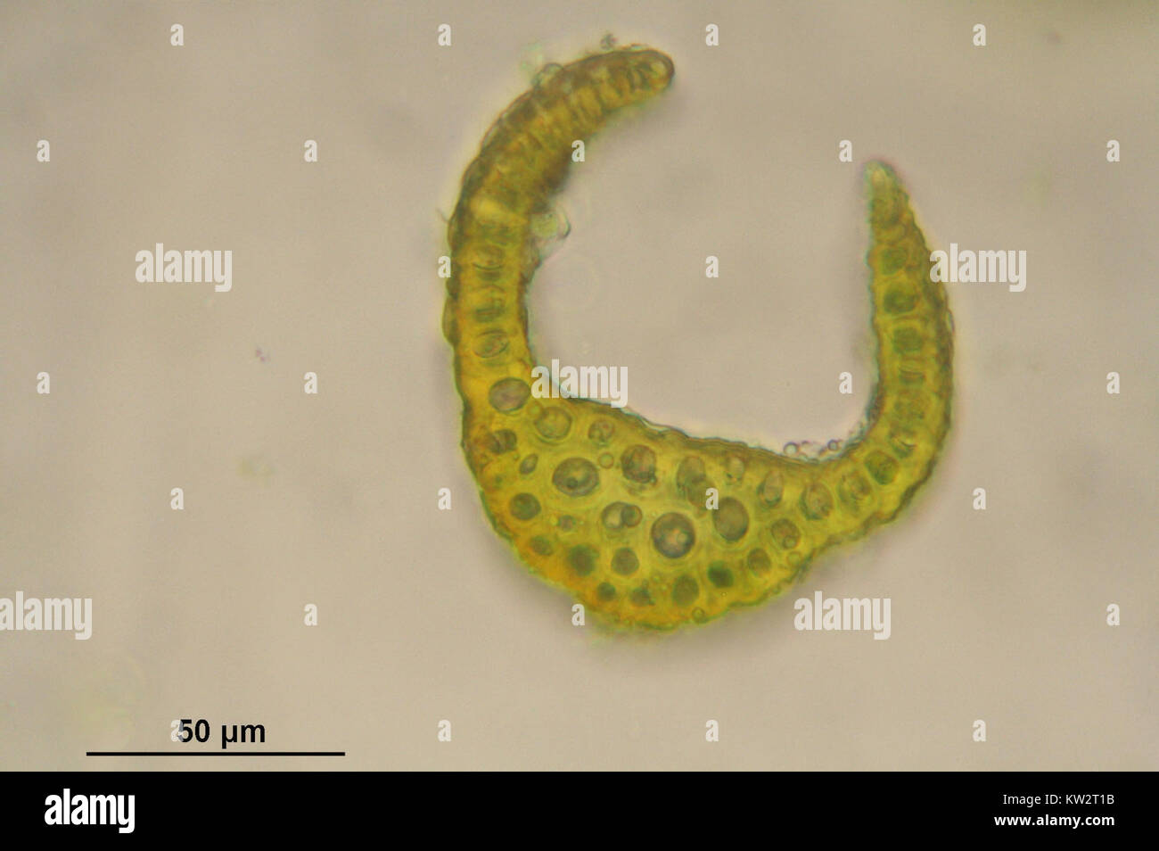 This image shows the plant species Blandia acuta, a moss known for its ...
