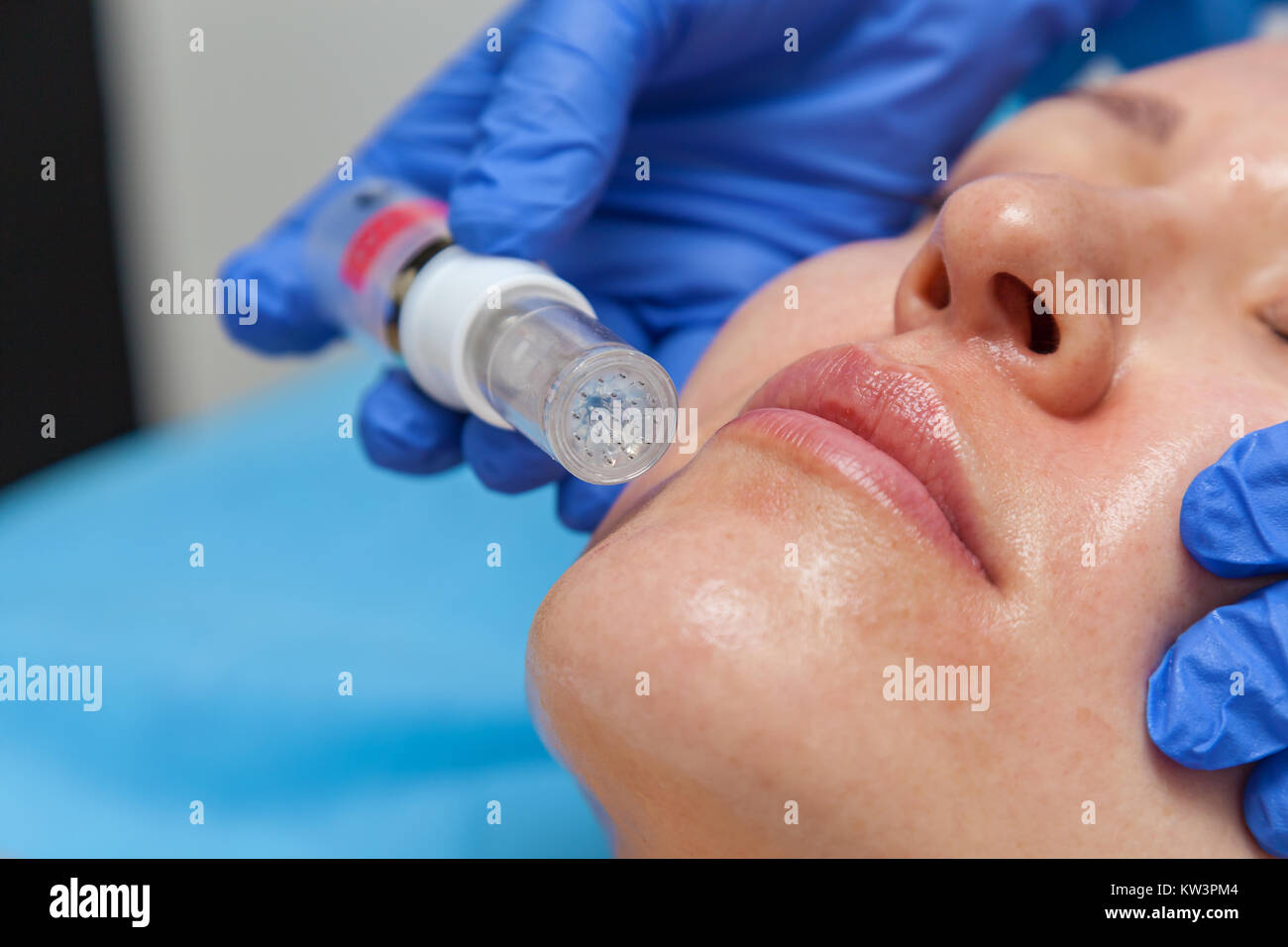 Cosmetic treatment by injection in the clinic. Use of a dermal injector ...