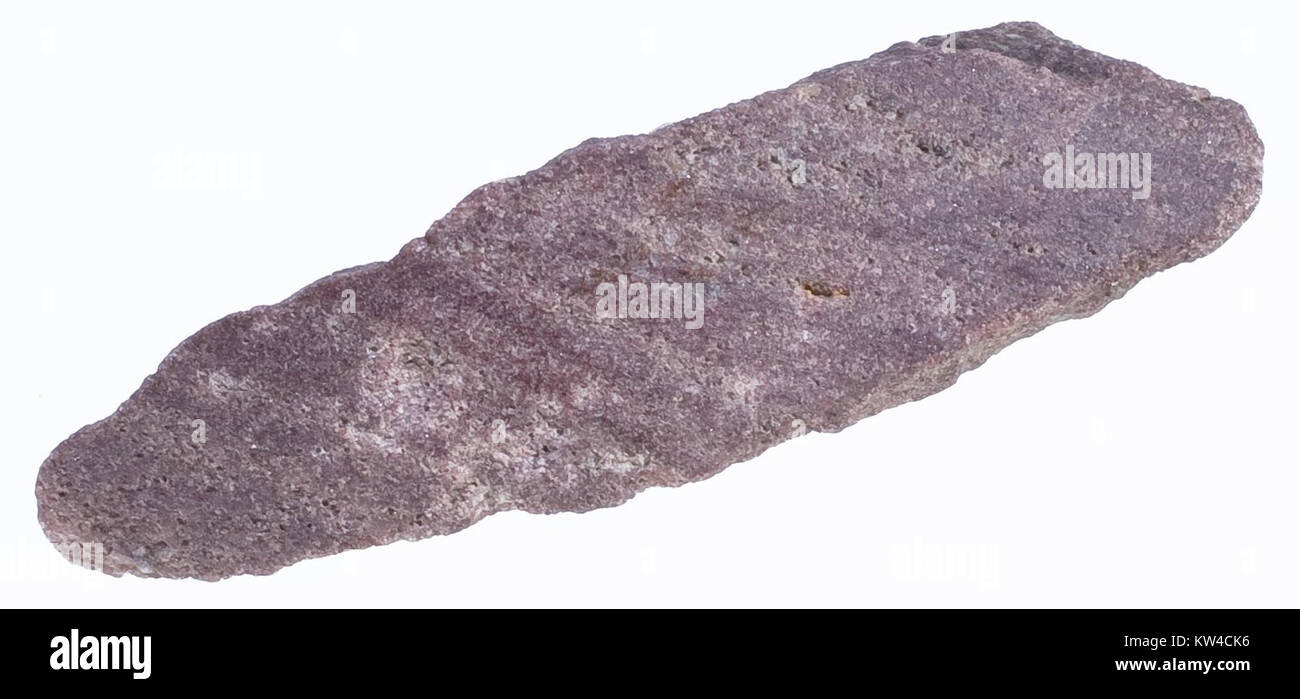 The Body Surface MET 57.180.171 is an anatomical model used in medical ...