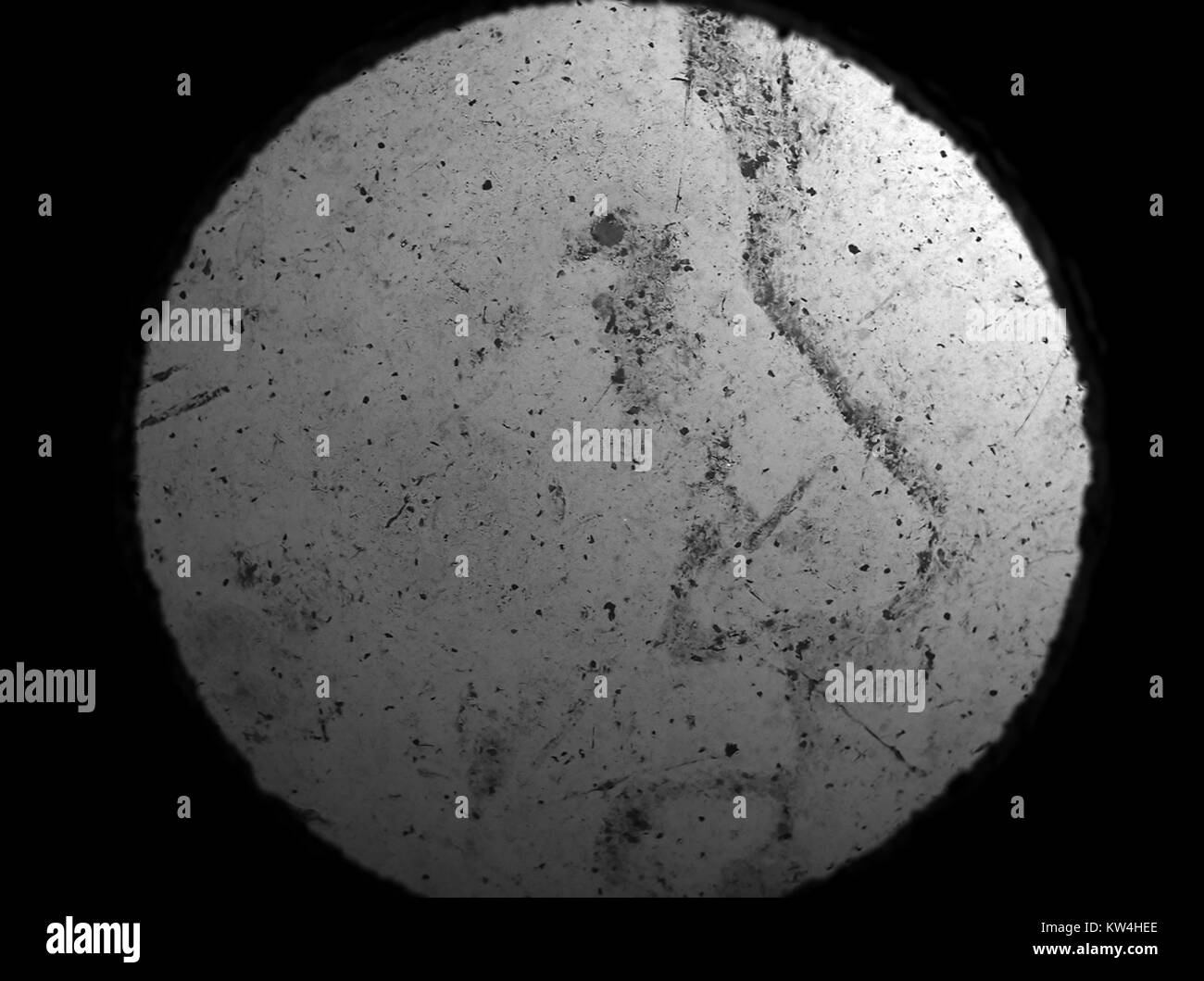 Blackheads Under Microscope