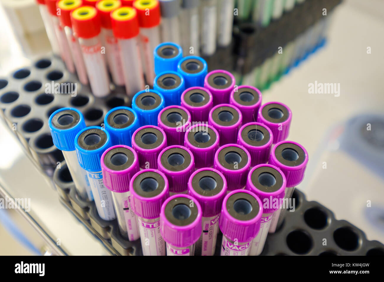 Test tubes with a blood in the clinic Stock Photo - Alamy