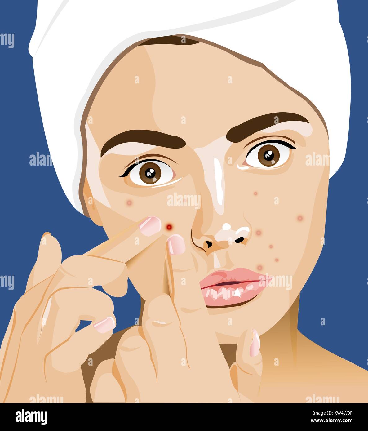 Girl with pimples, acne, facial cleansing, adolescence. Skin problems ...
