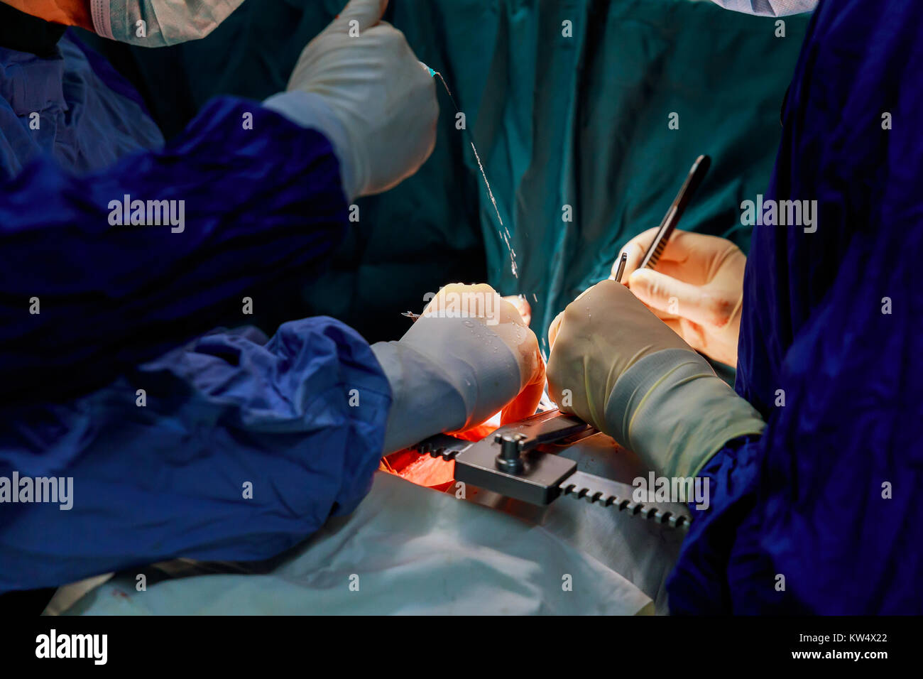 Operation incision surgeon hands hi-res stock photography and images ...