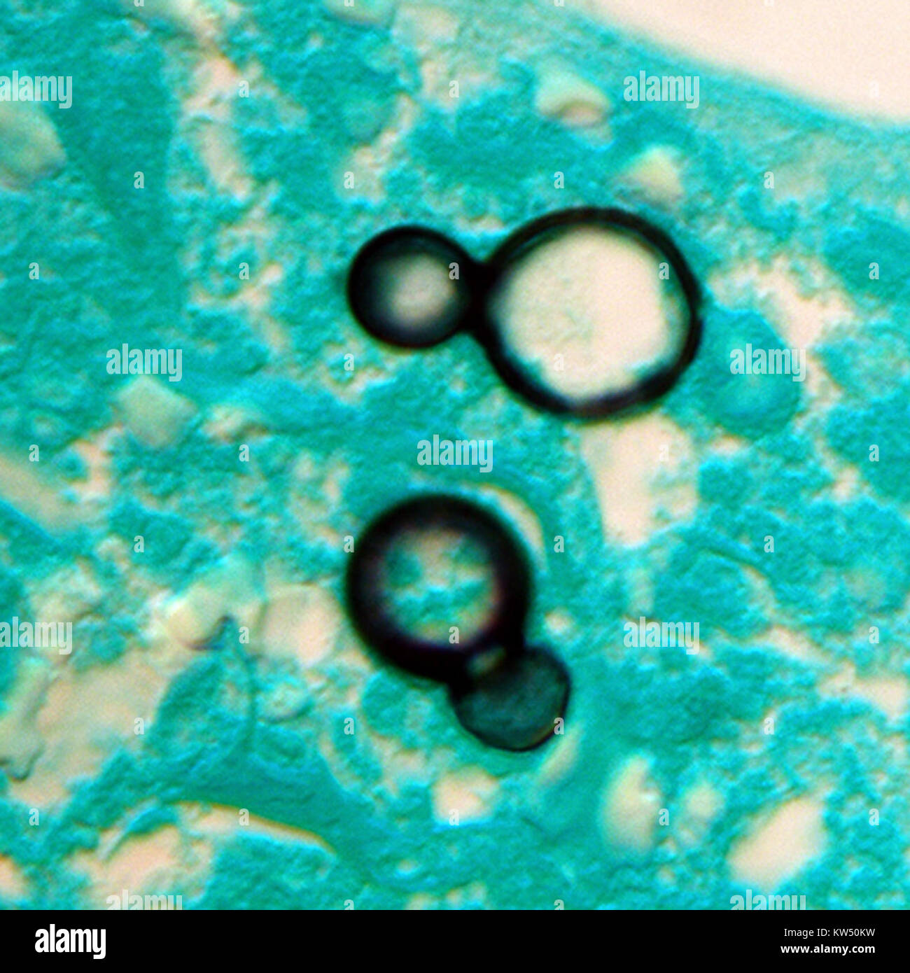 Blastomyces dermatitidis GMS Stock Photo - Alamy