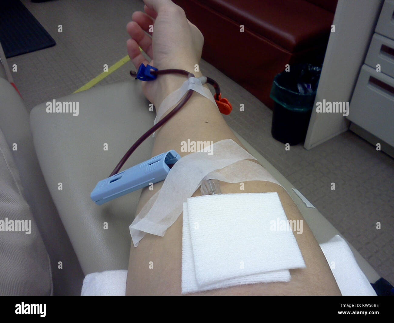 This image captures a blood donation procedure, with the donorâ€™s ...