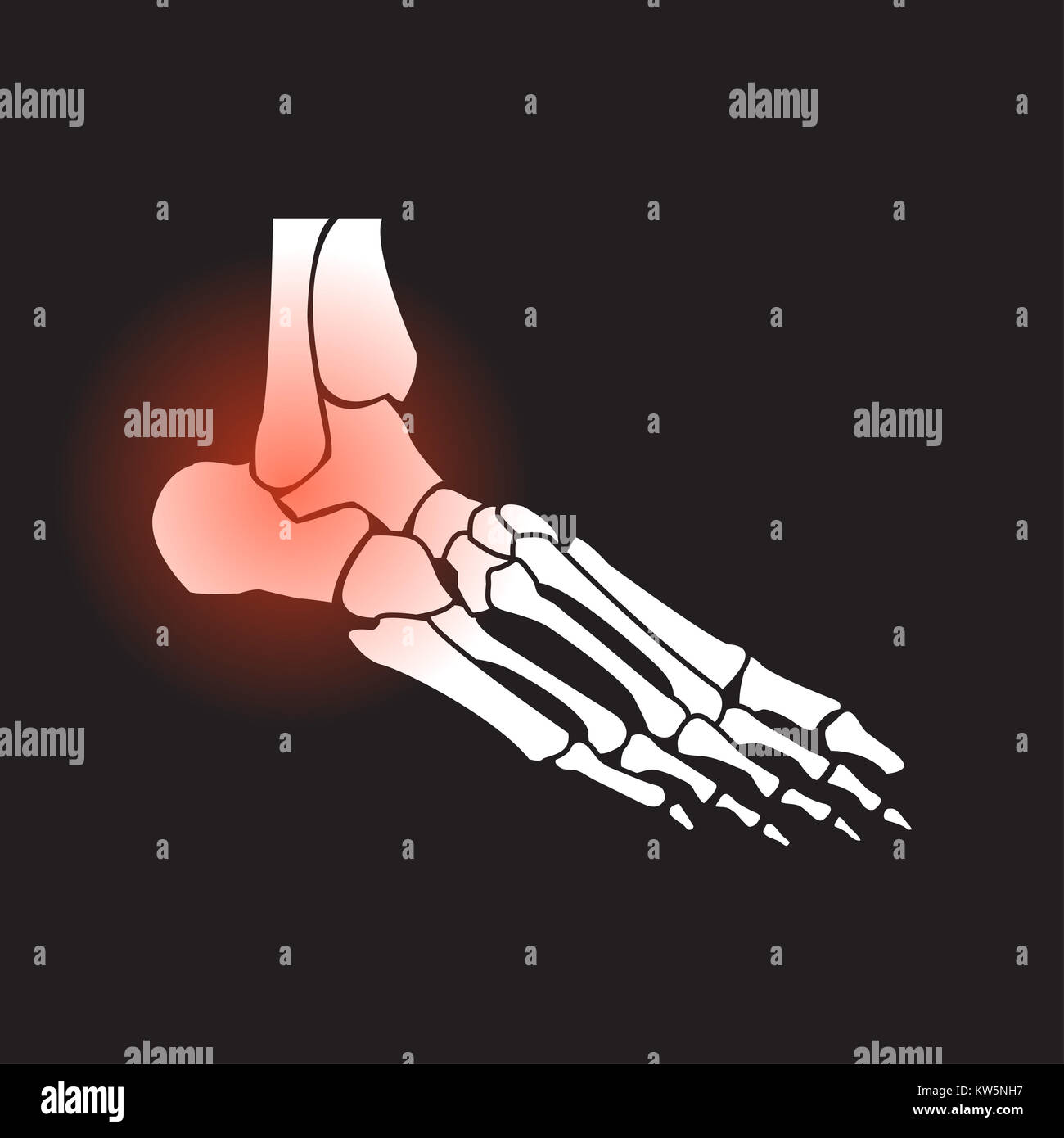 Foot anatomy bones side view hi-res stock photography and images - Alamy