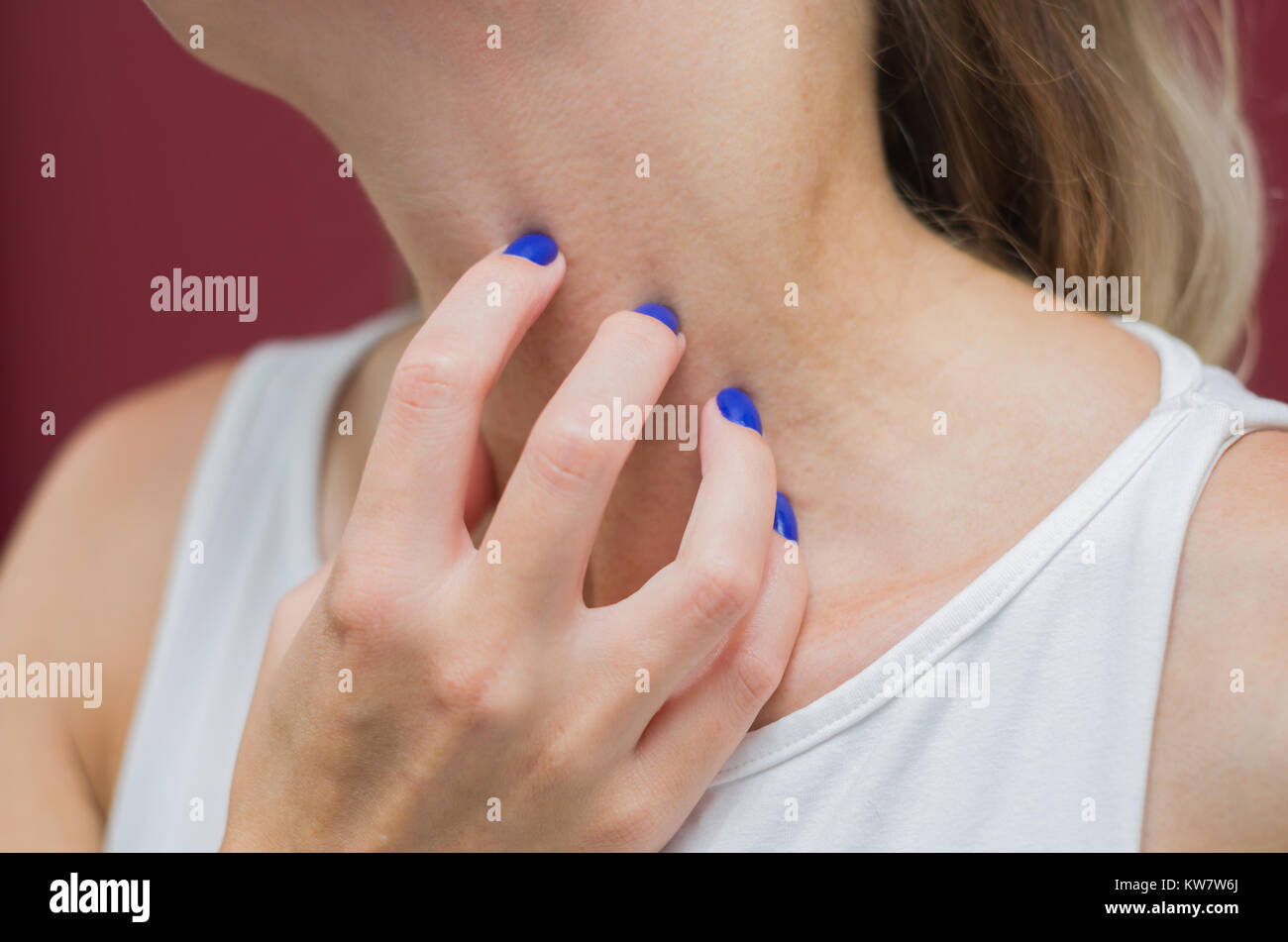 Great concept of allergy and skin diseases, young woman scratching ...
