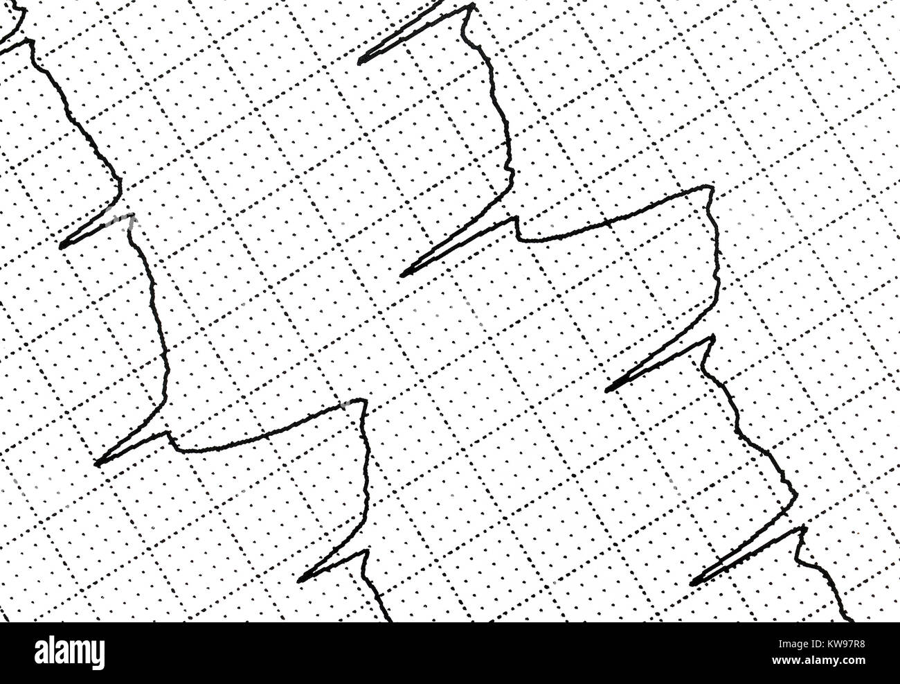 Electrocardiogram test that shows electrical activity of the heart ...