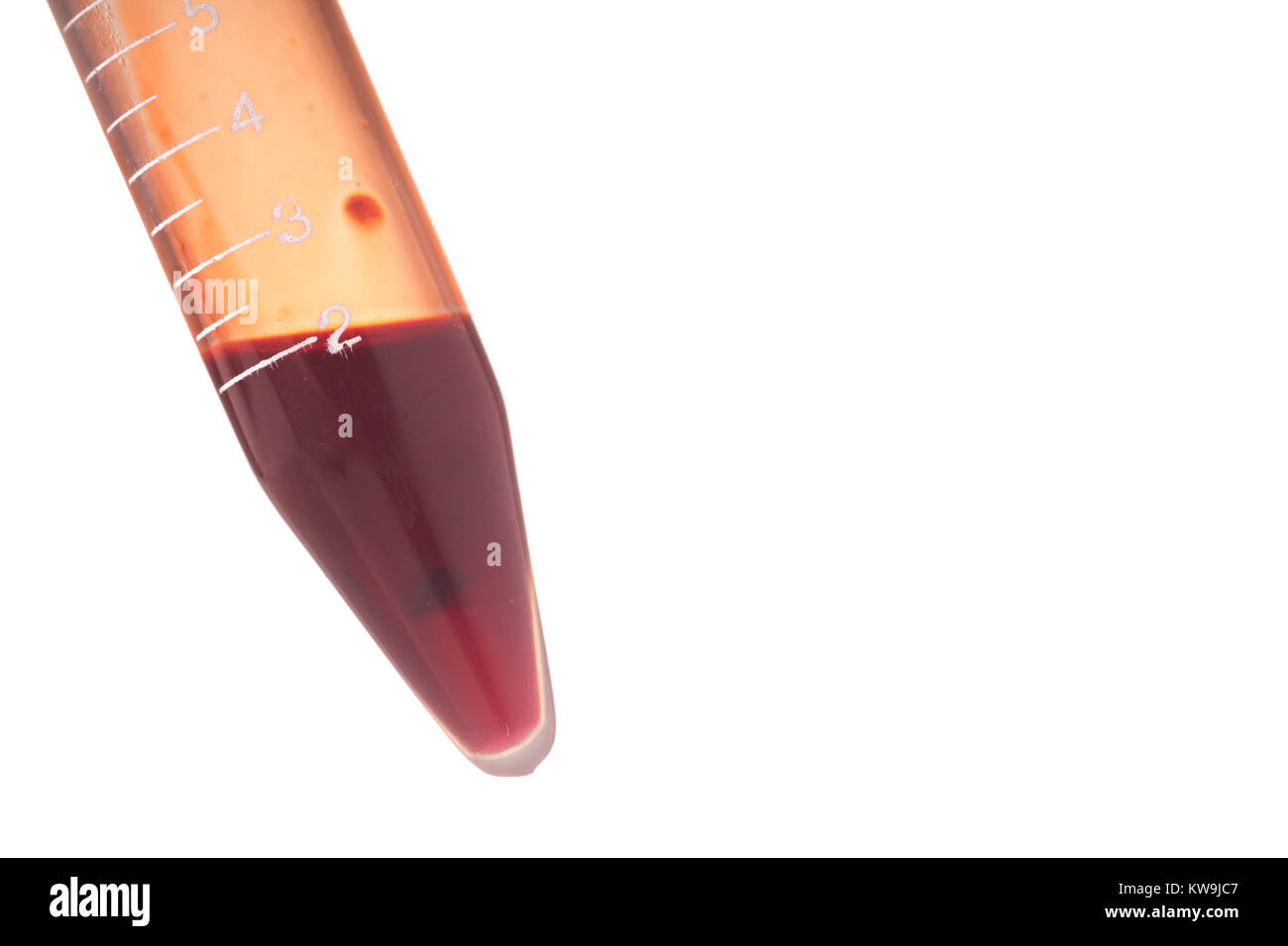 blood sample or other medical test isolated on white background Stock ...