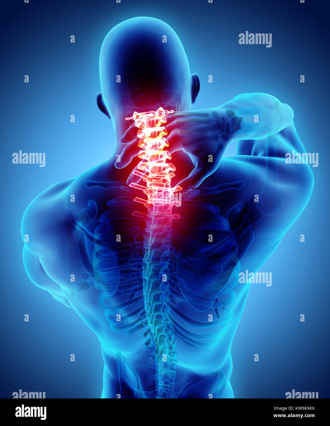 3D illustration, neck painful - cervical spine skeleton x-ray, medical ...