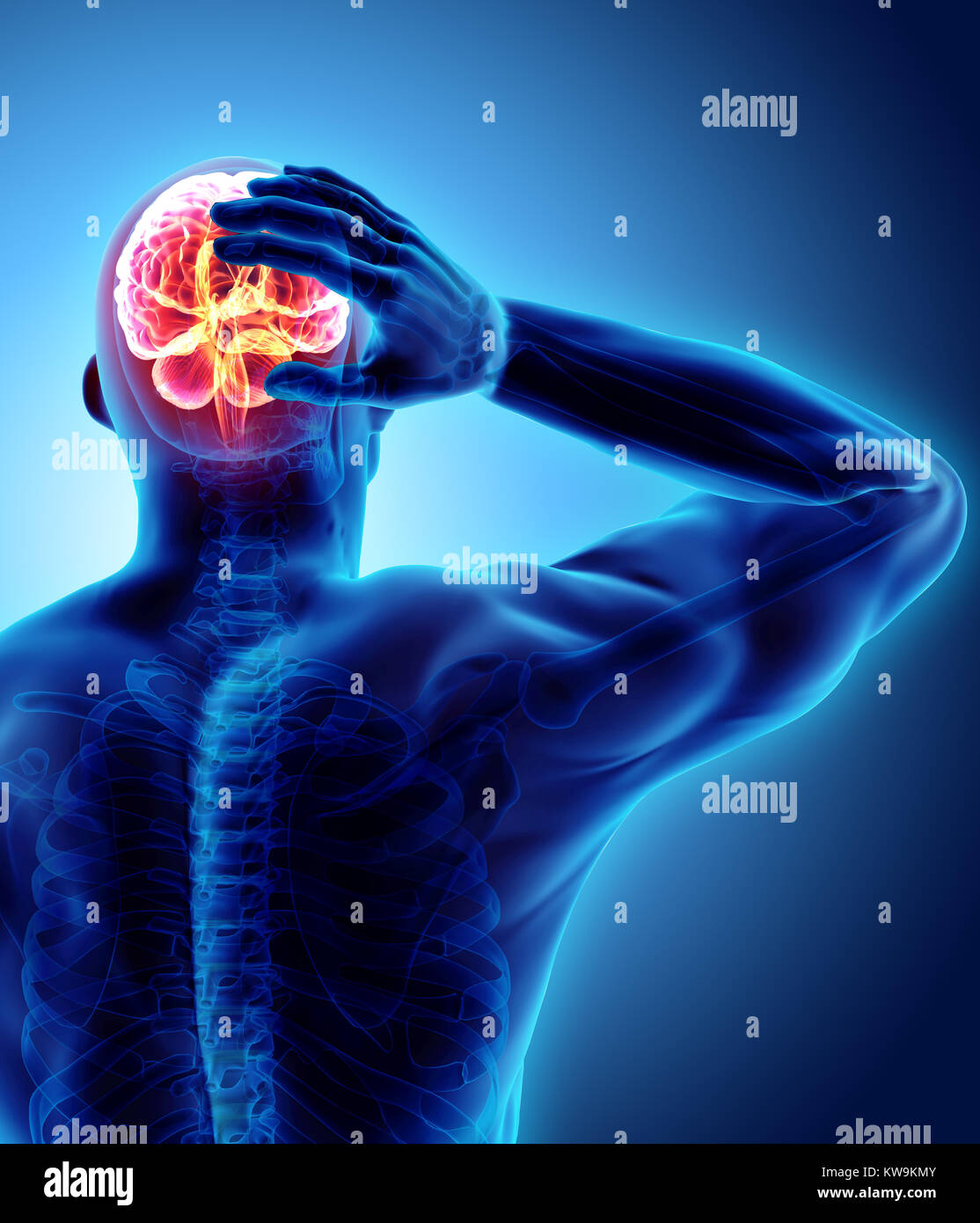 3d illustration of headache human, x-ray medical concept Stock Photo ...