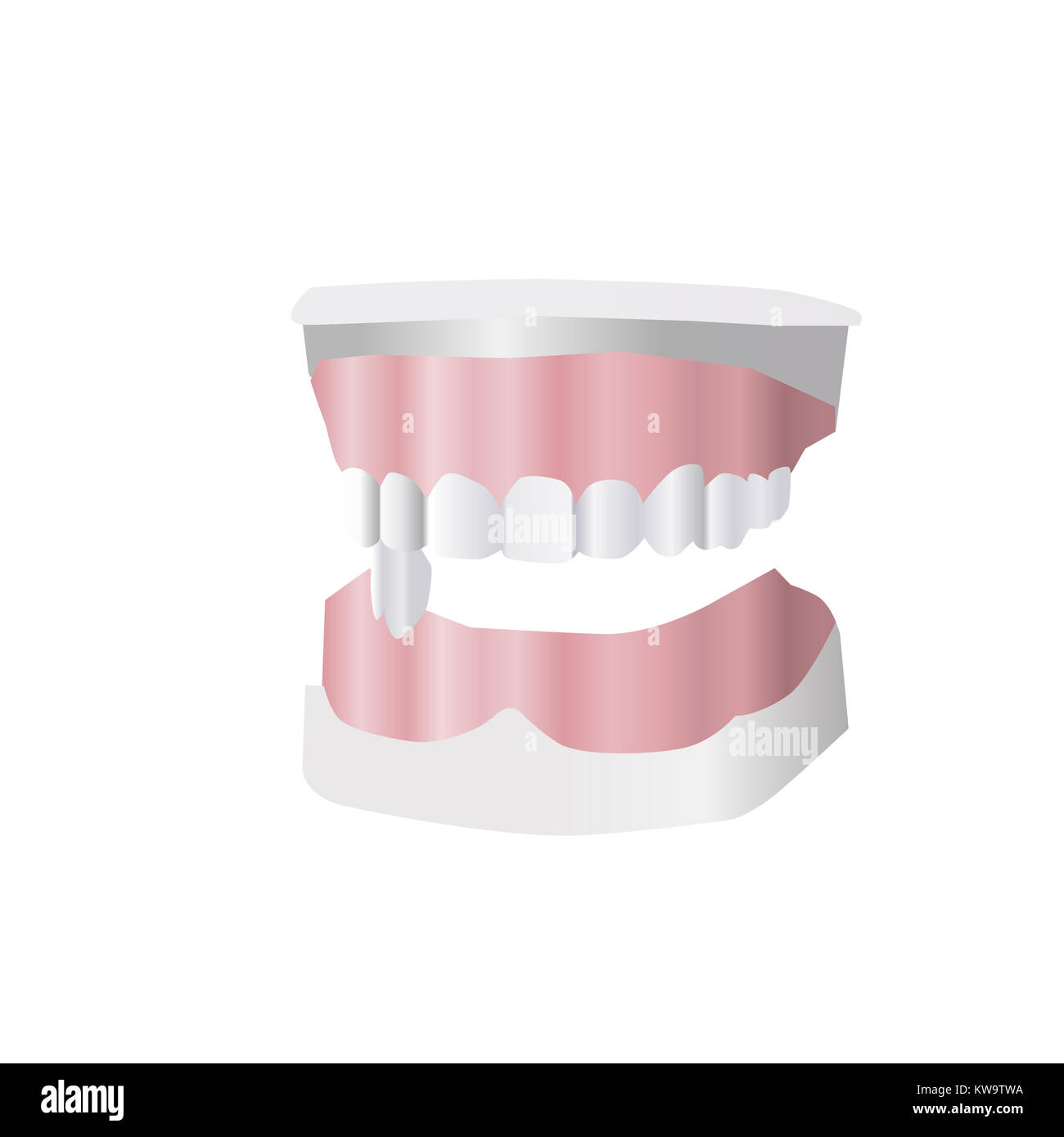 Dental Model of teeth and broken Isolated on white background Vector ...