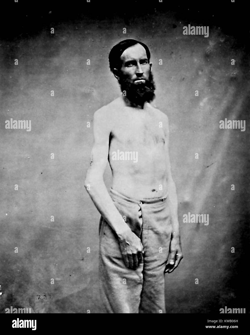Photograph Of A Shirtless Male Soldier From The American Civil War photograph-of-a-shirtless-male-soldier-from-the-american-civil-war