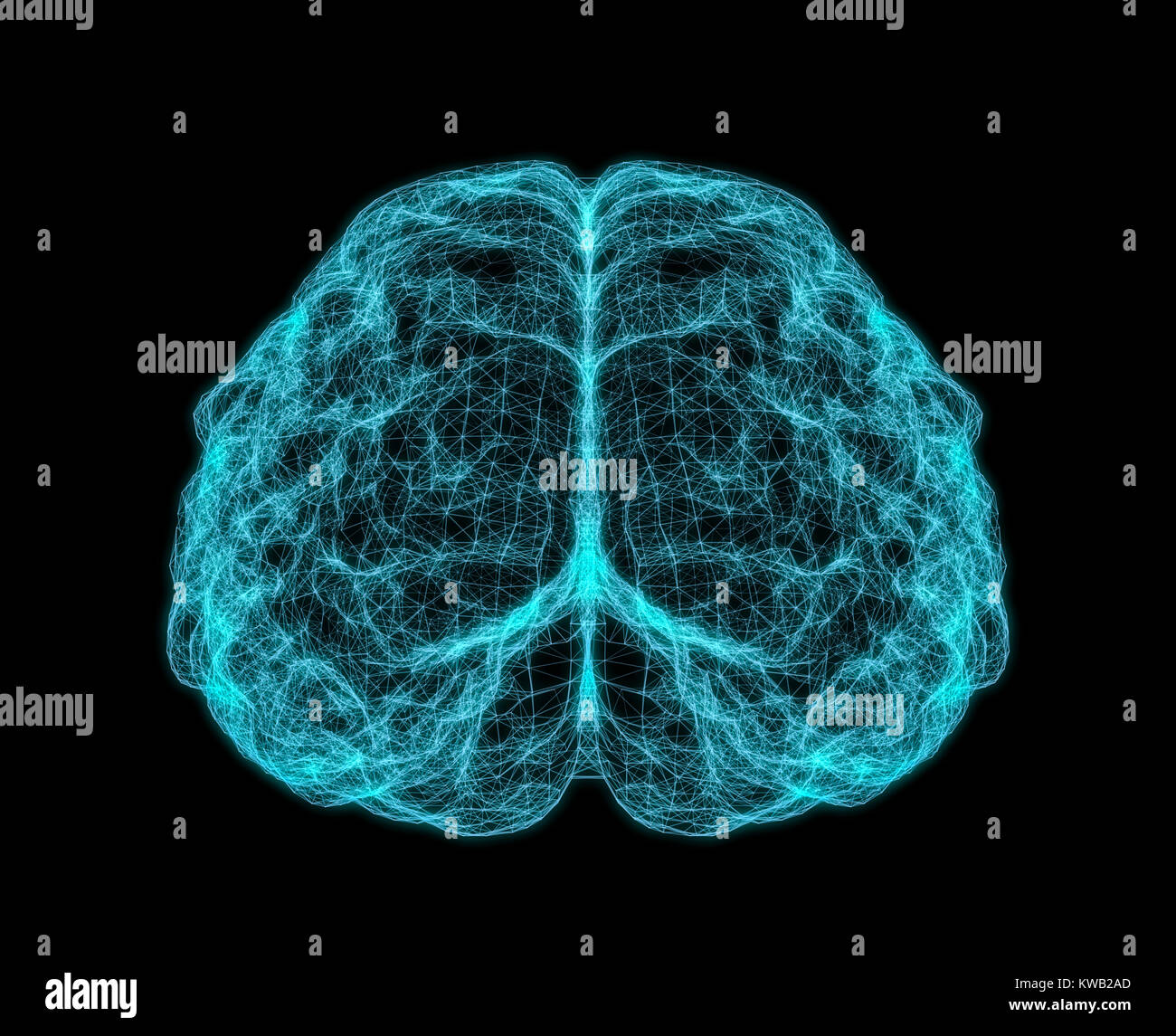 X-ray image of human brain Stock Photo - Alamy