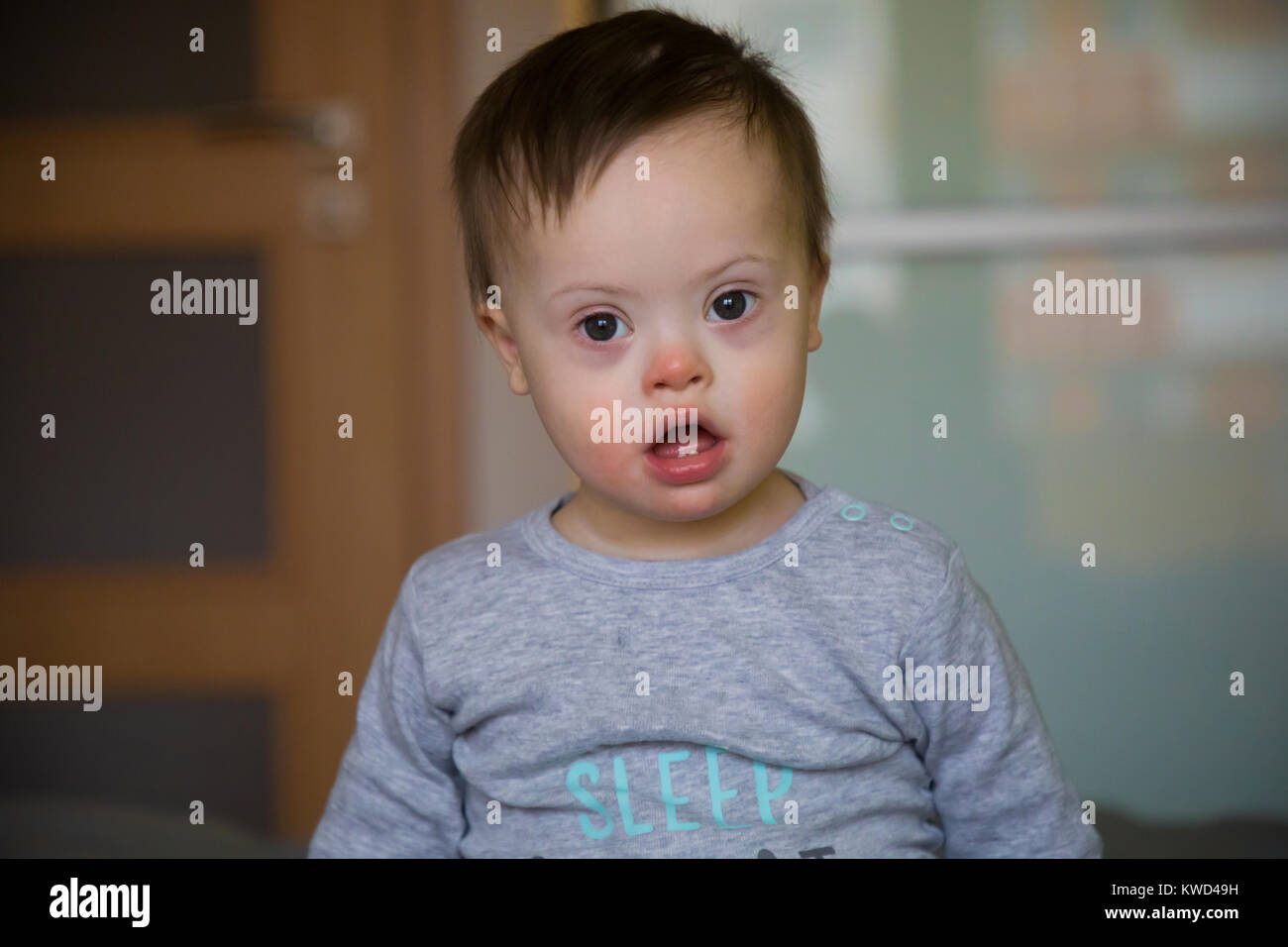 Portrait of cute baby boy with Down syndrome Stock Photo - Alamy