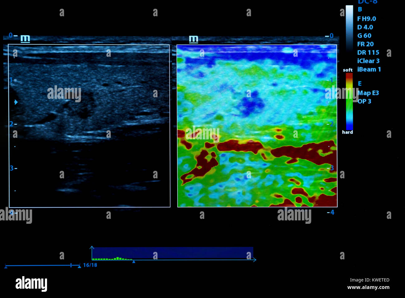 Imaging tool hi-res stock photography and images - Alamy