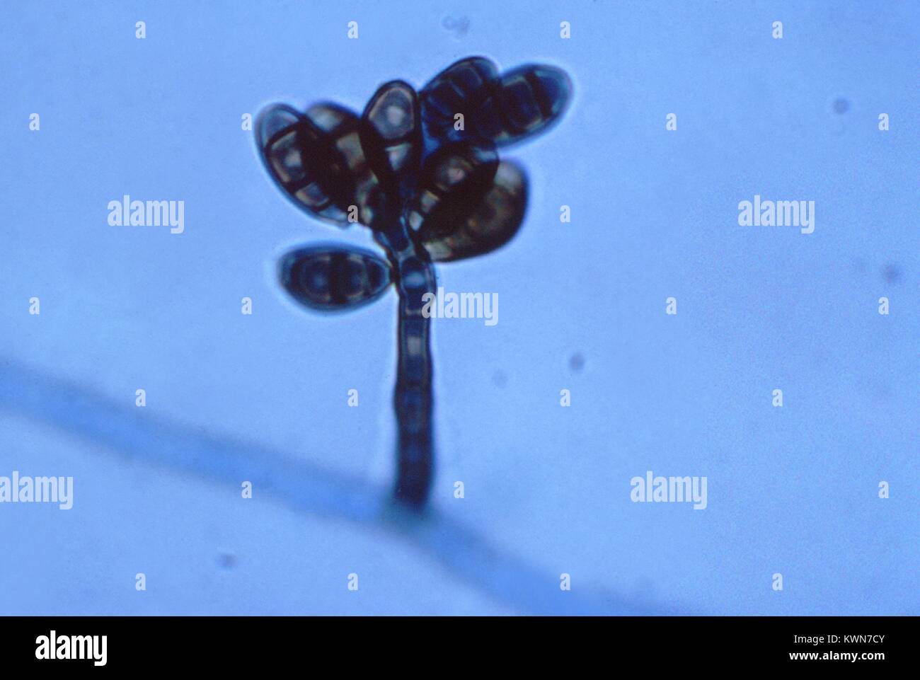 This photomicrograph shows a conidiophore of the fungus Curvularia ...