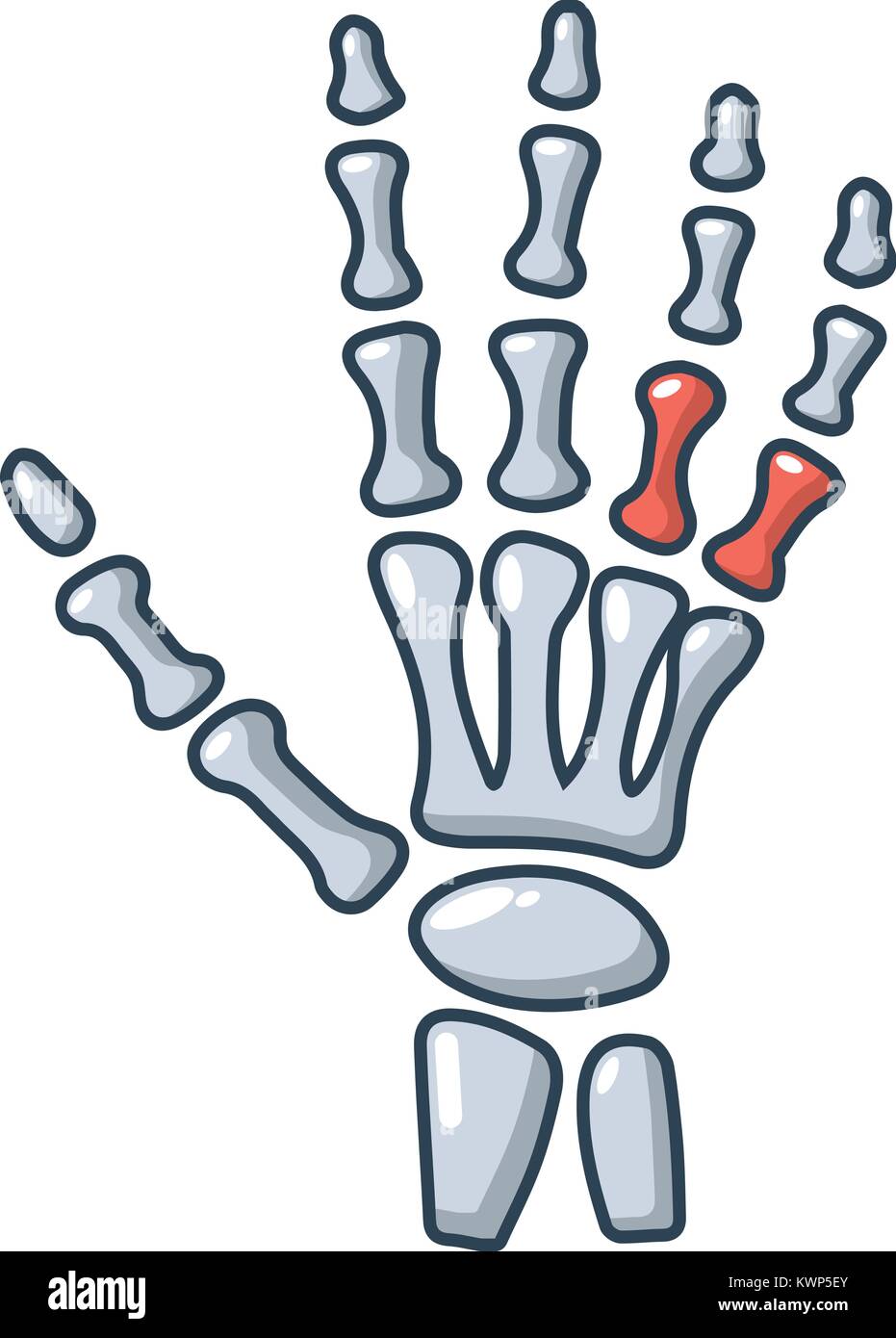 Inflammation of hand icon, cartoon style Stock Vector Image & Art - Alamy