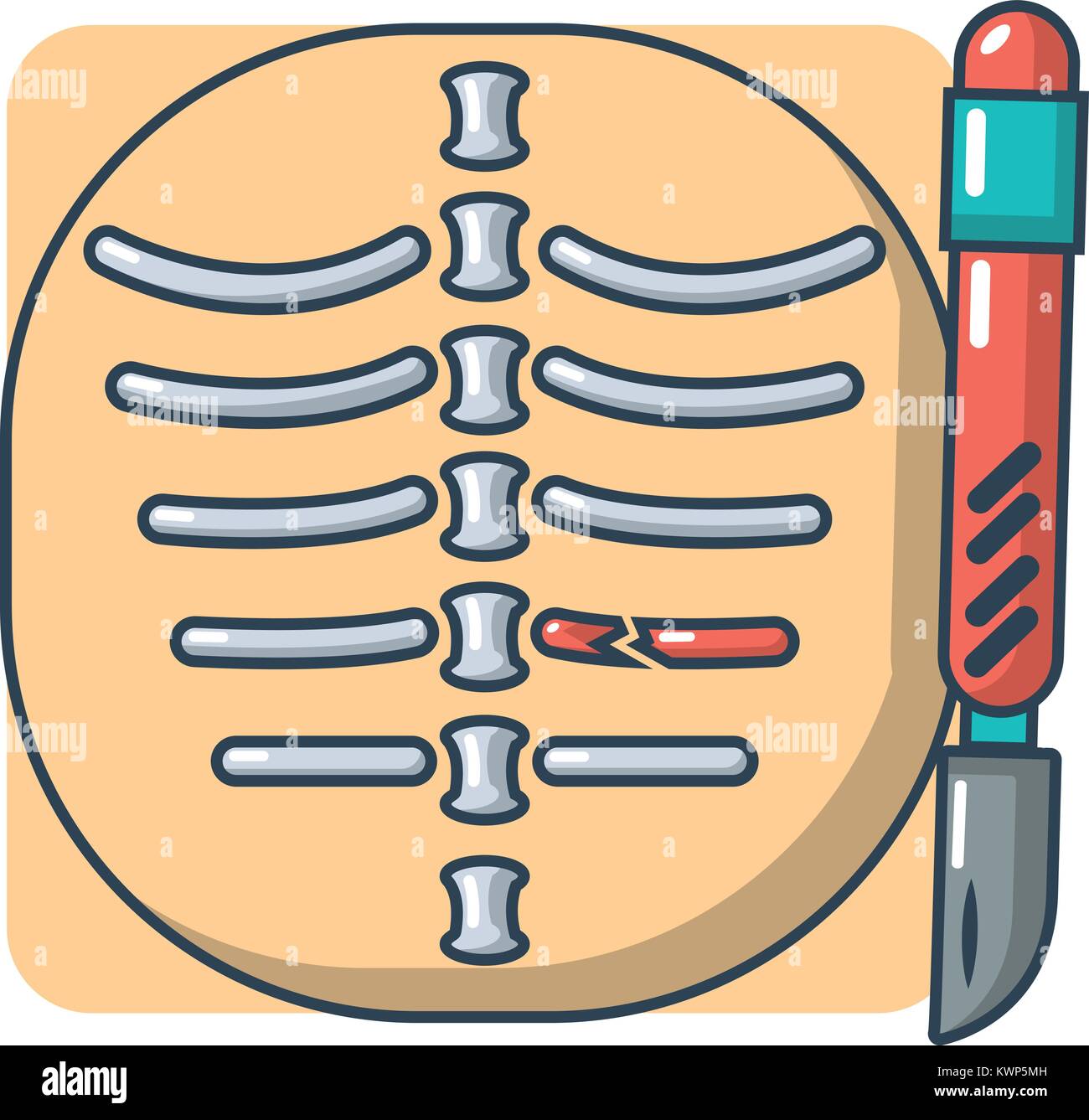 Rib Fracture High Resolution Stock Photography and Images - Alamy