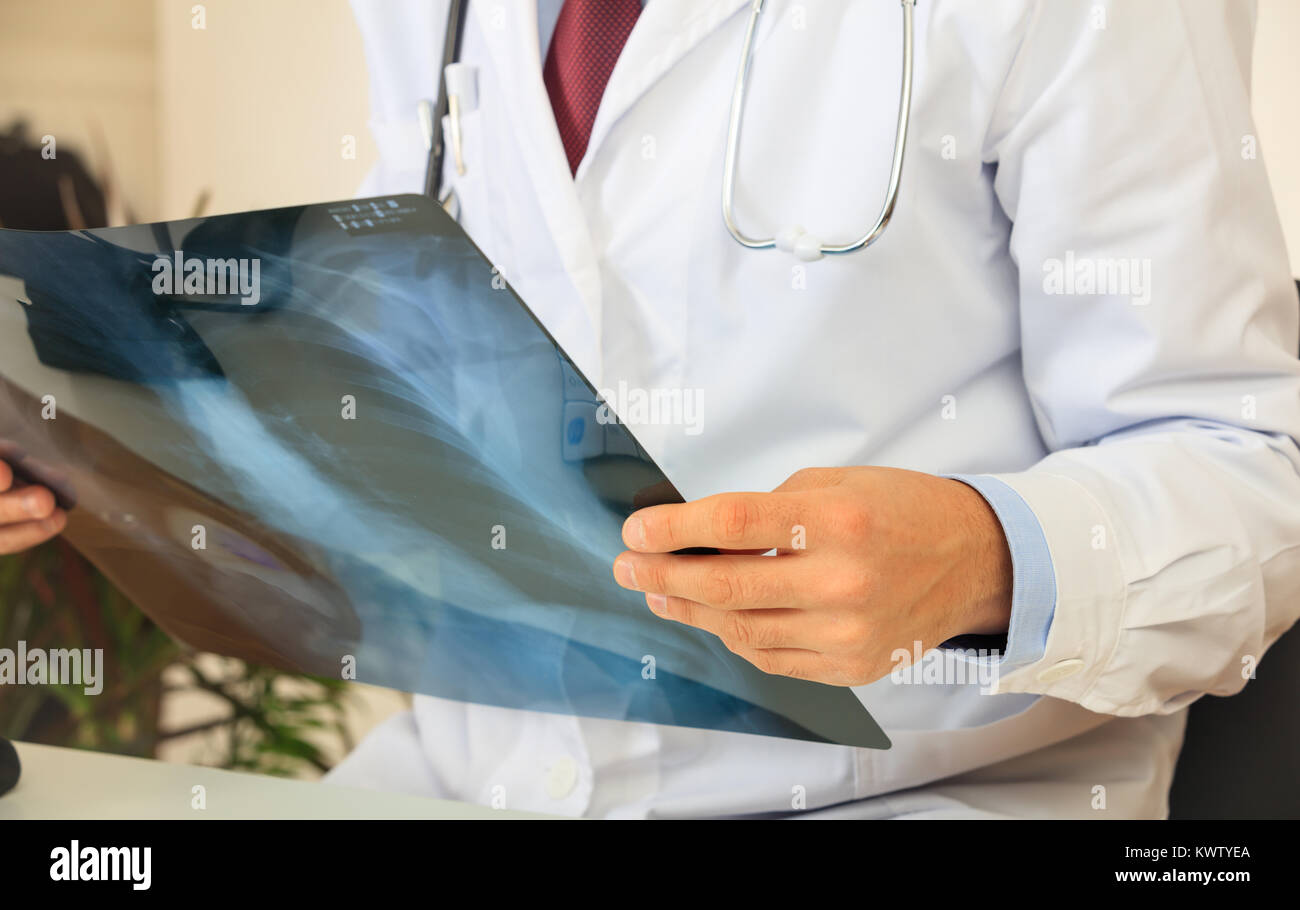 Doctor looking at xray hi-res stock photography and images - Alamy