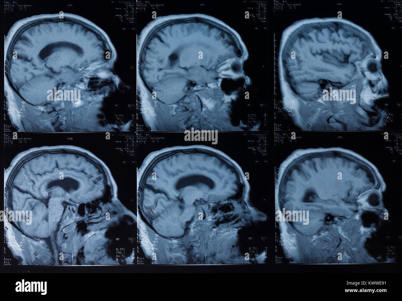 Head MRT. MR image of human brain Stock Photo - Alamy