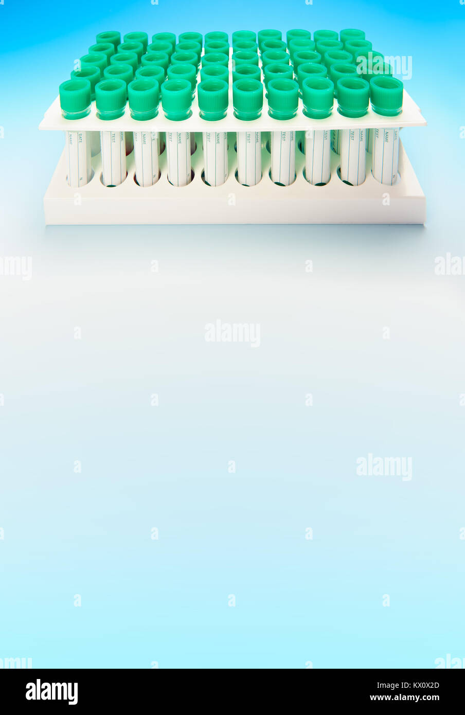 Blood Collection Tubes with Anticoagulants in a tube stand, medical ...