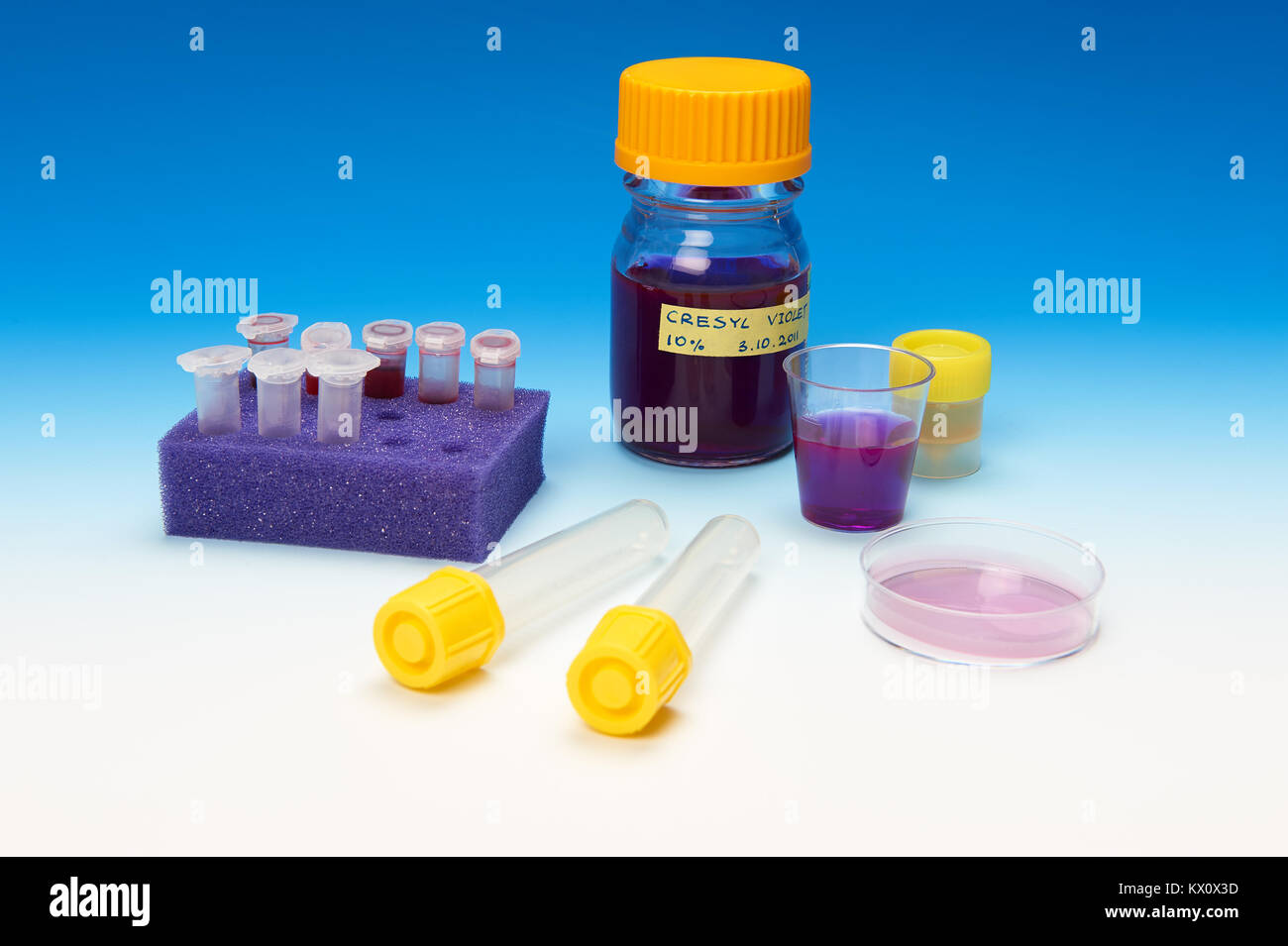 Patient microscopic samples and staining solutions on blue background ...