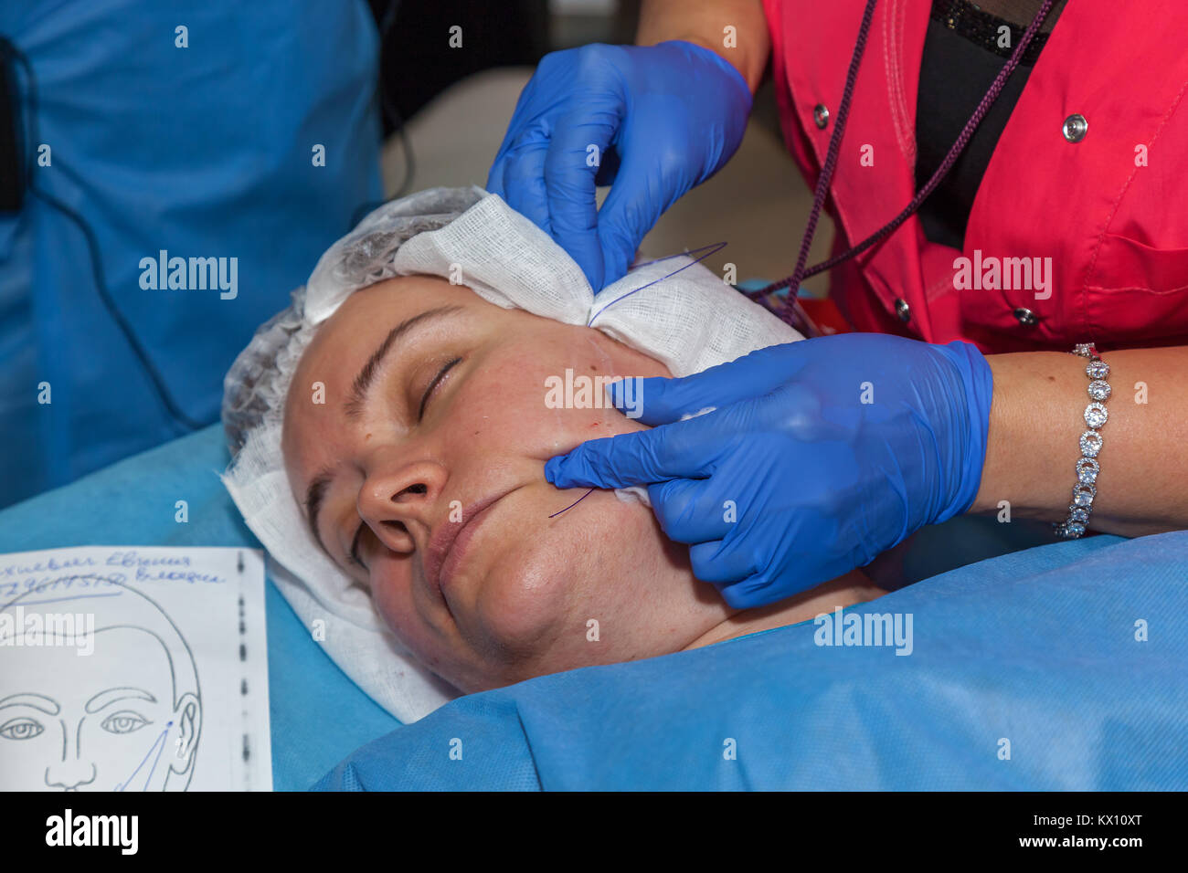lifting of threads Stock Photo - Alamy