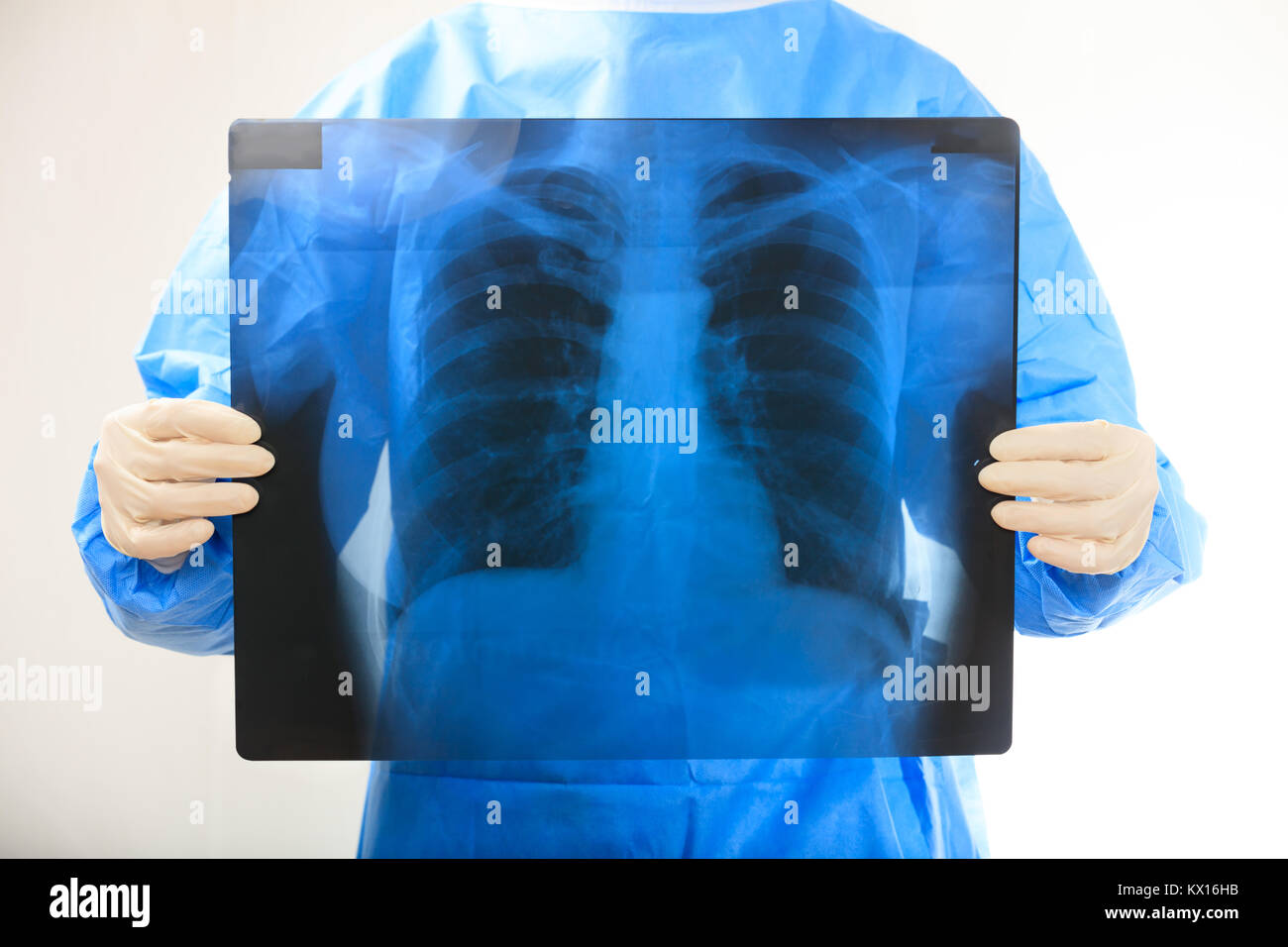 Doctor holding xray hi-res stock photography and images - Alamy