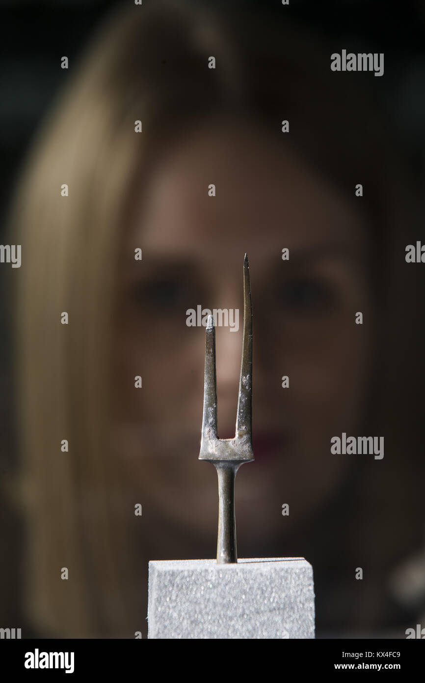 A cod's skull used to teach anatomy and a fork surgically removed from ...