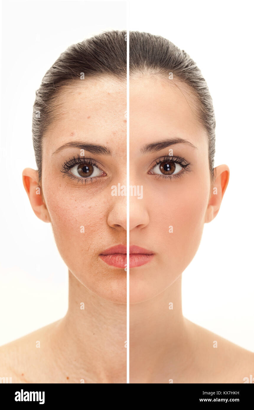 woman's face, beauty concept before and after contrast, power of ...