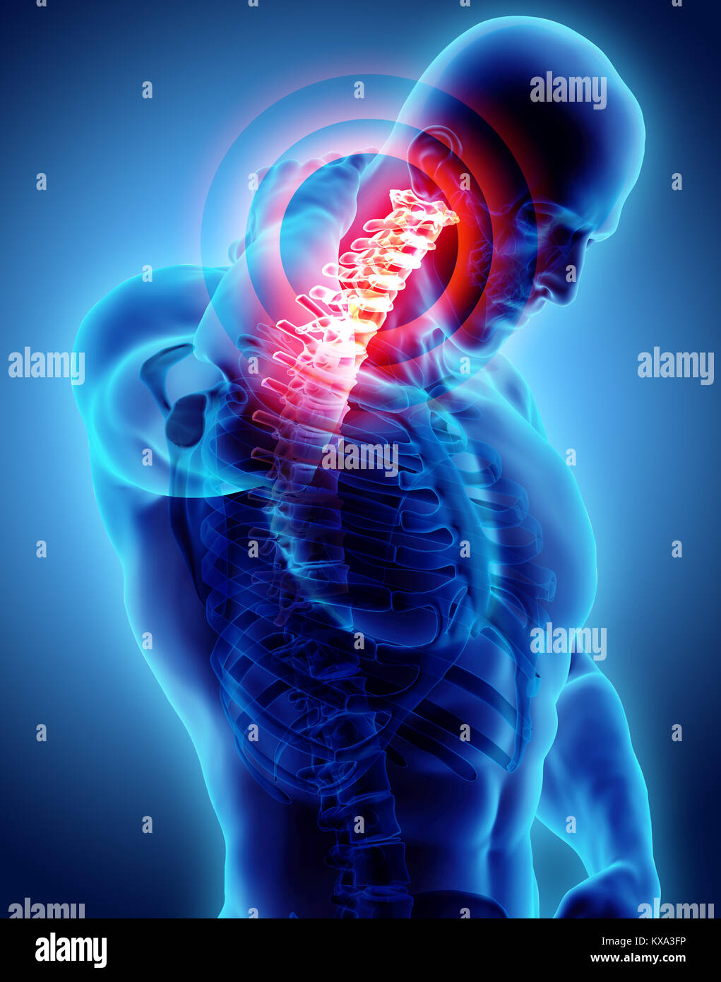 3D illustration, neck painful - cervical spine skeleton x-ray, medical ...