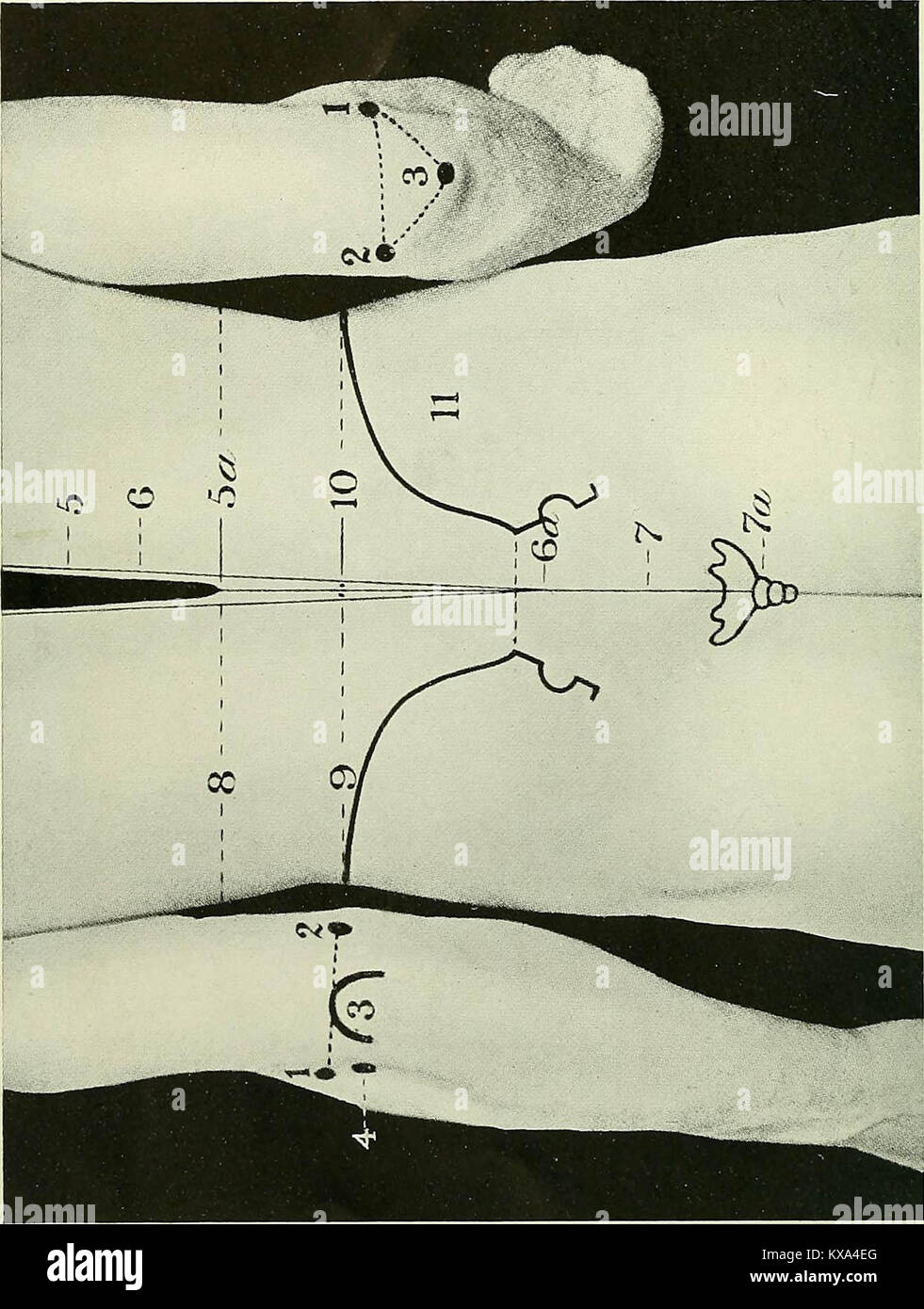 "Landmarks and surface markings of the human body" (1913 Stock Photo ...