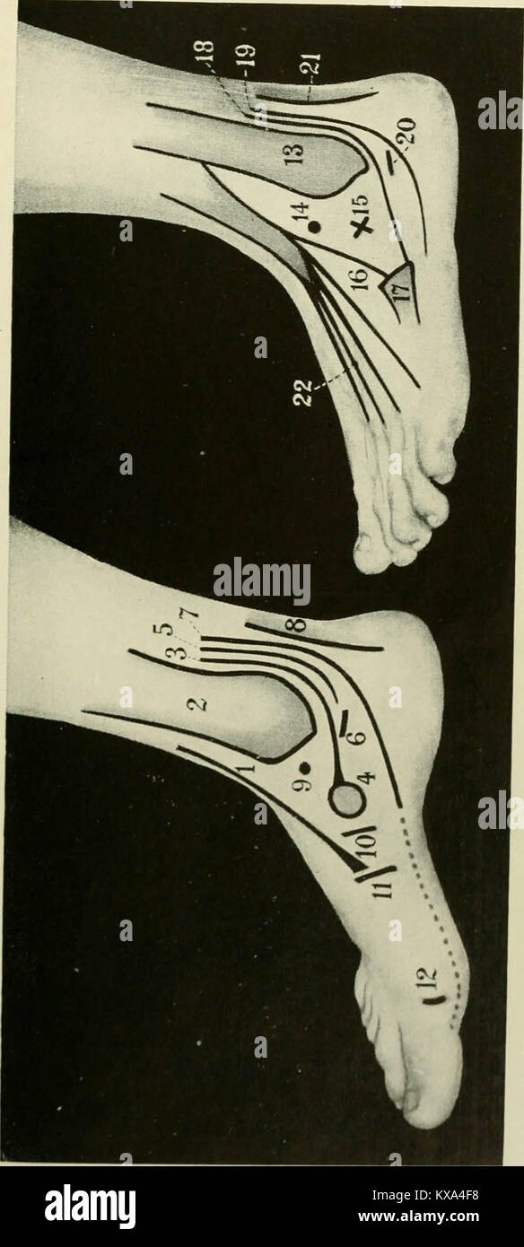 "Landmarks and surface markings of the human body" (1913 Stock Photo ...