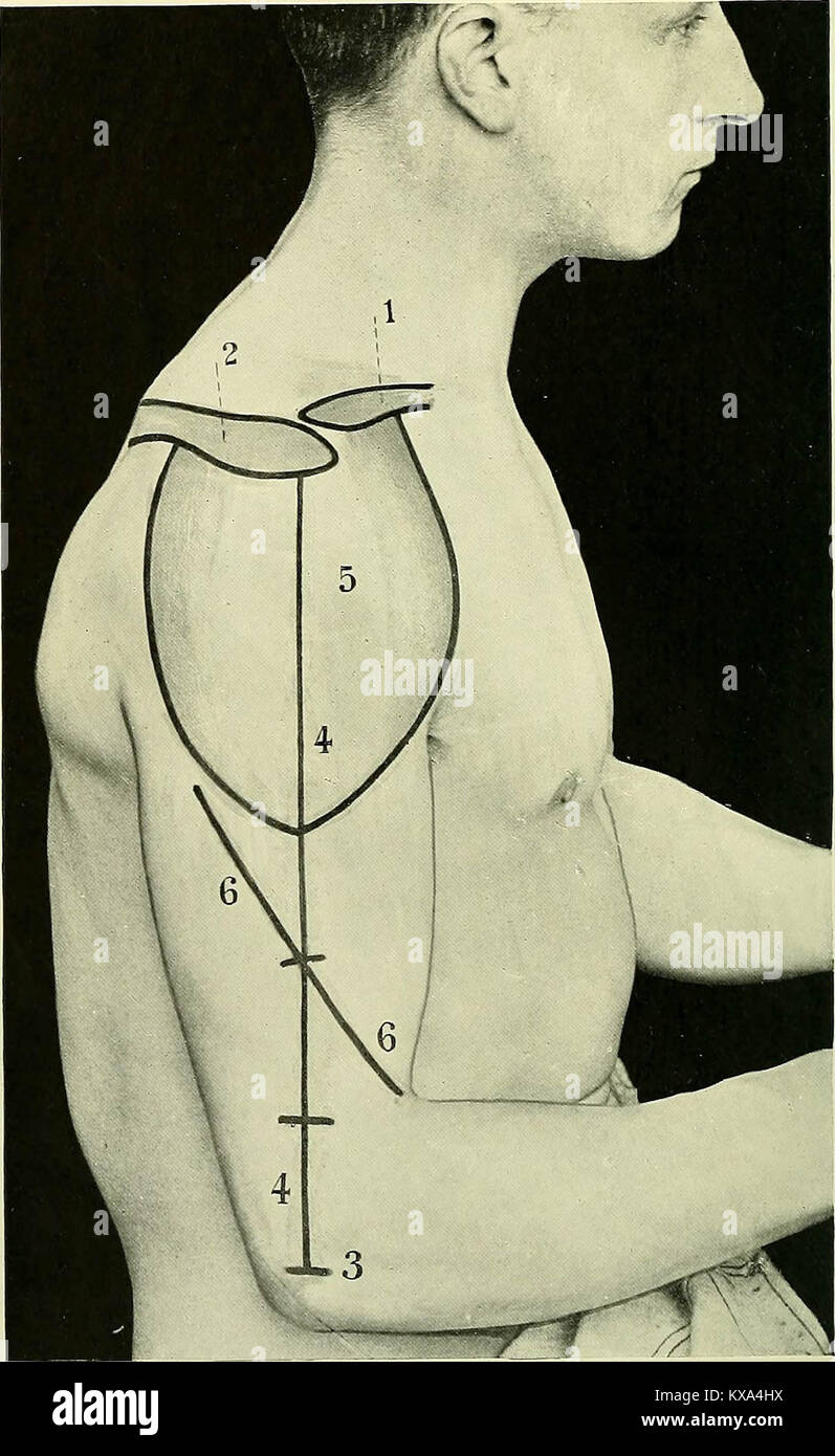 "Landmarks and surface markings of the human body" (1913 Stock Photo ...
