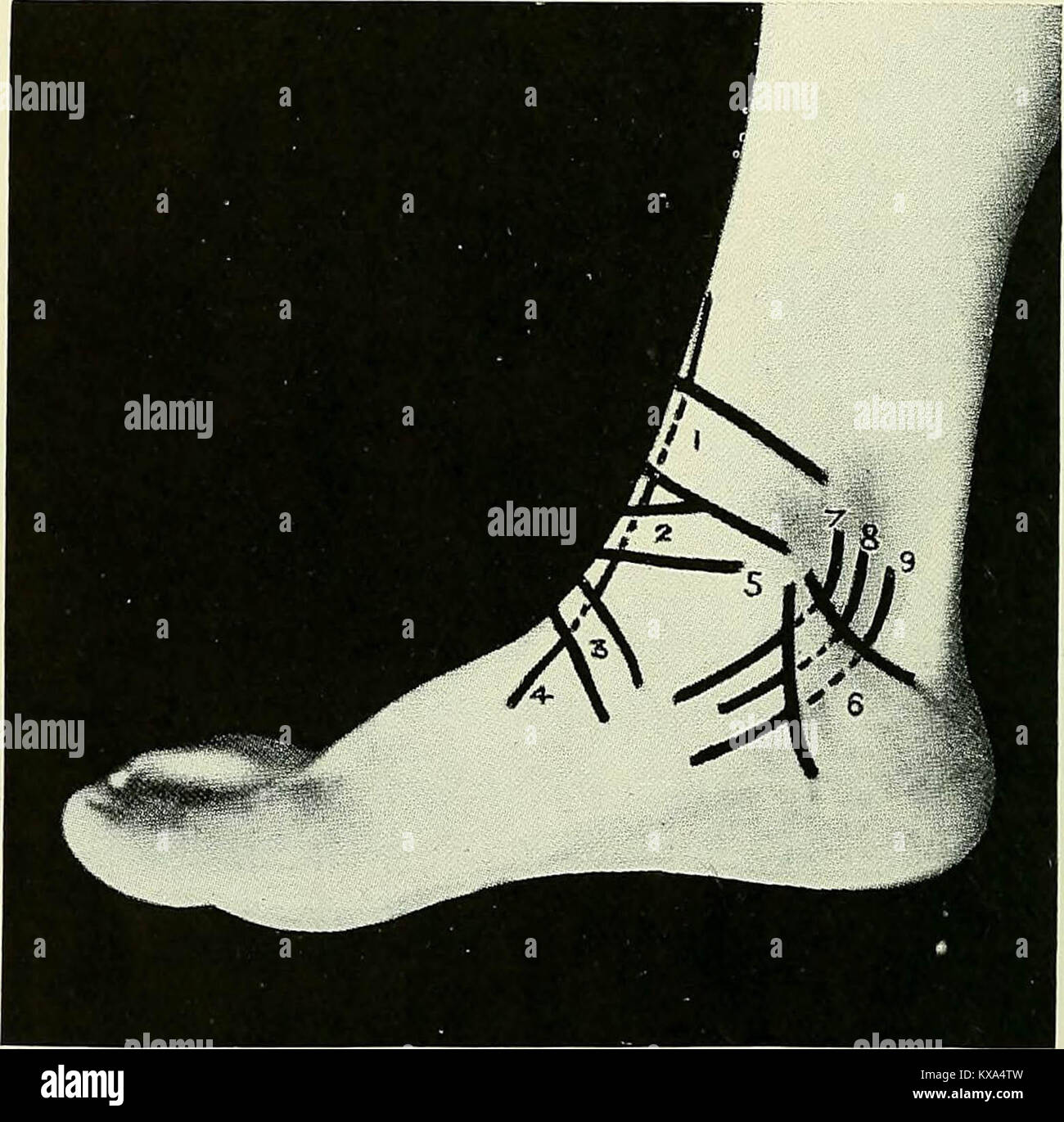"Landmarks and surface markings of the human body" (1913 Stock Photo ...