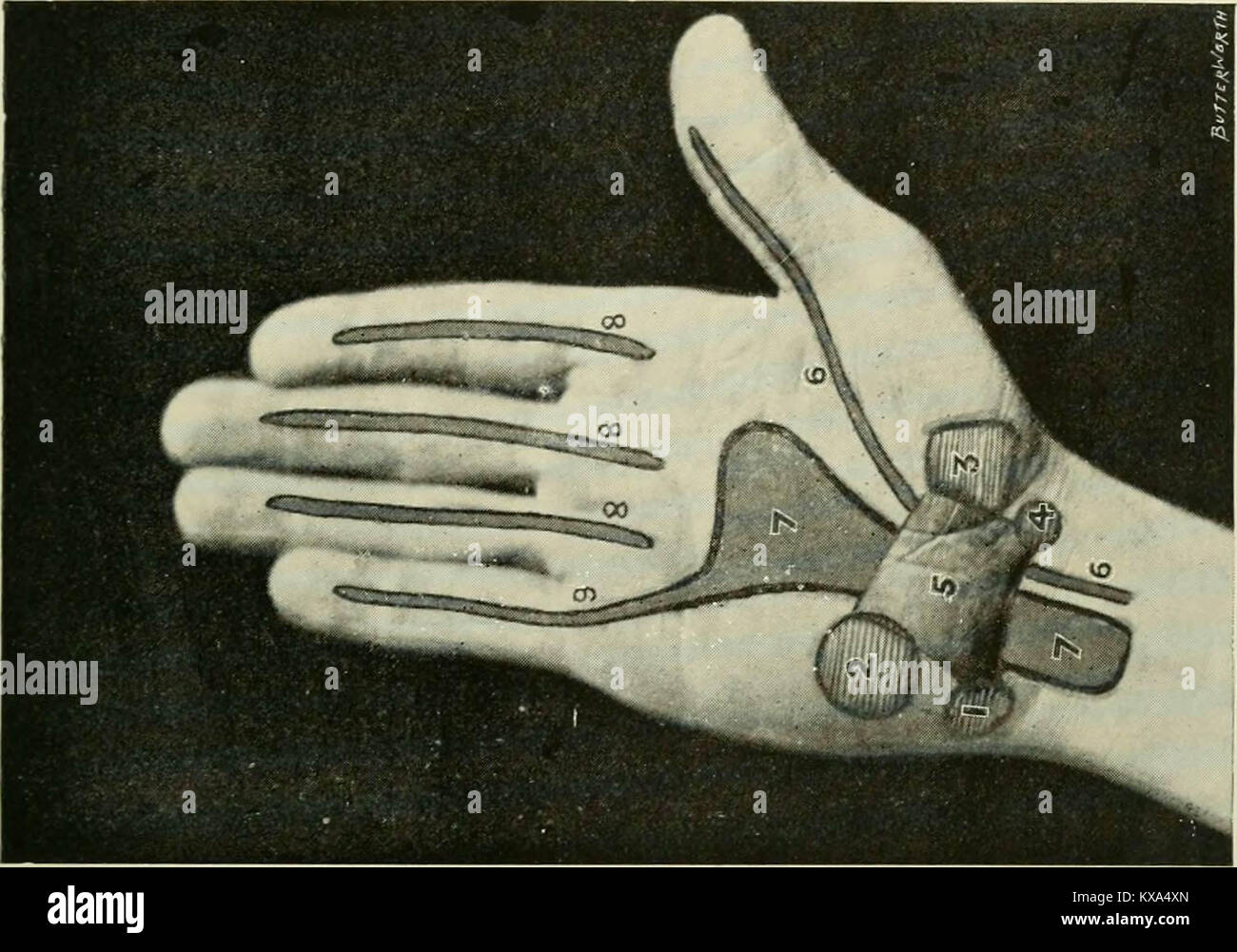 "Landmarks and surface markings of the human body" (1913 Stock Photo ...