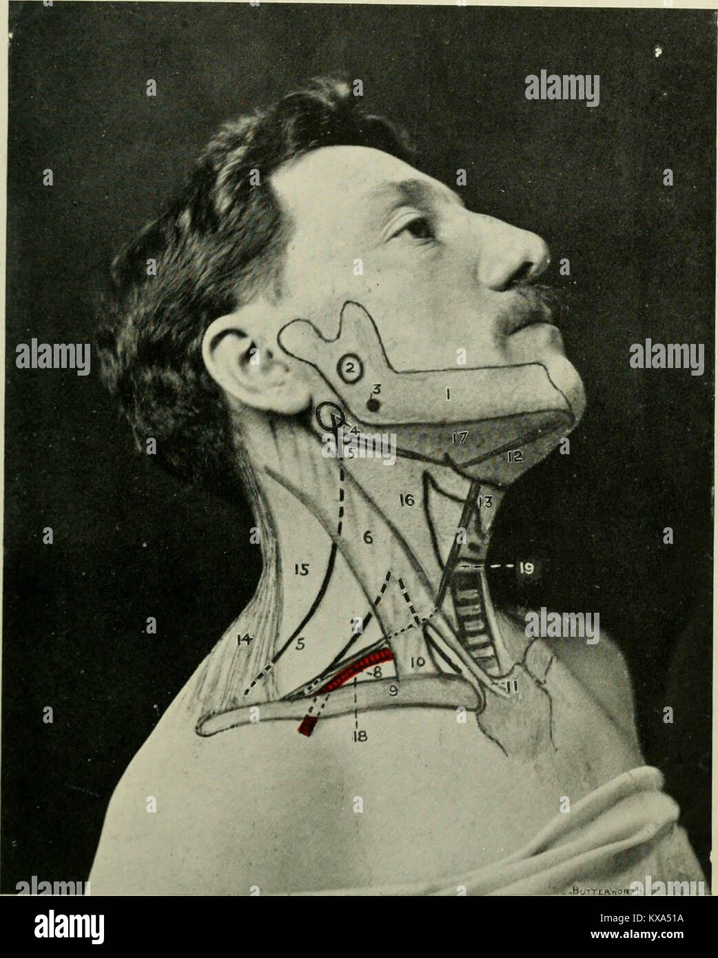"Landmarks and surface markings of the human body" (1913 Stock Photo ...