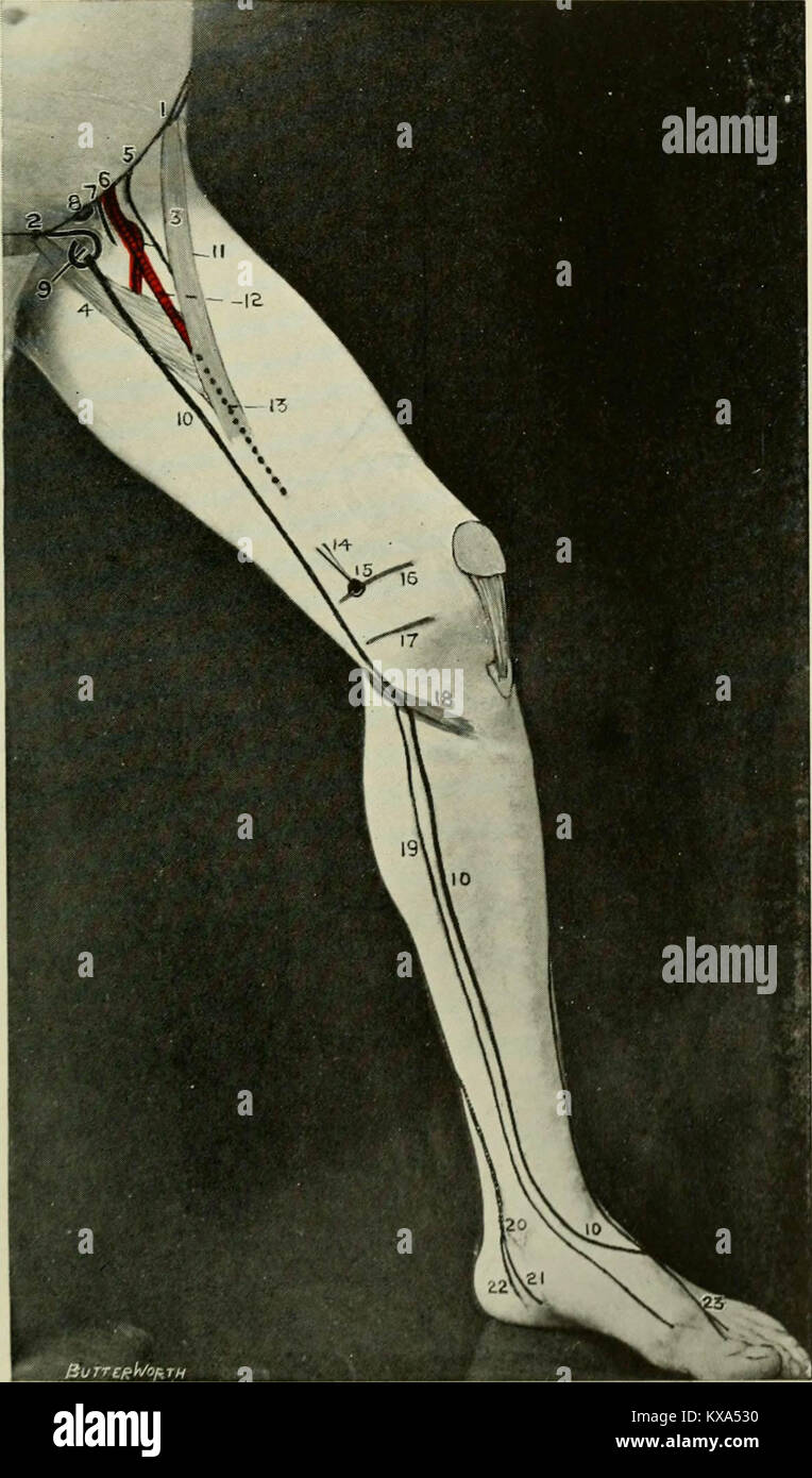 "Landmarks and surface markings of the human body" (1913 Stock Photo ...