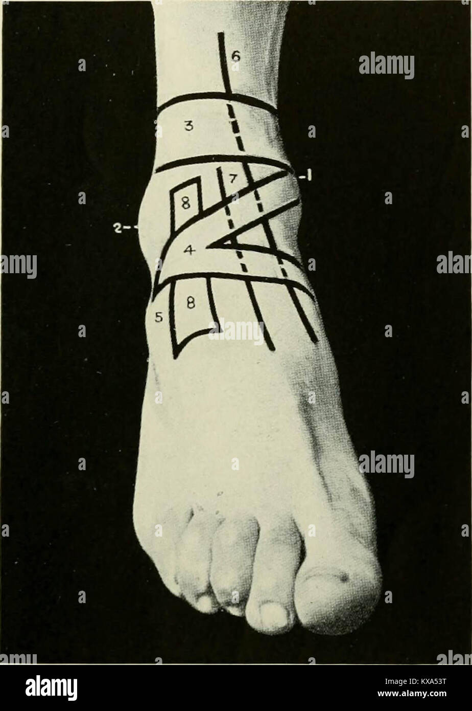 "Landmarks and surface markings of the human body" (1913 Stock Photo ...
