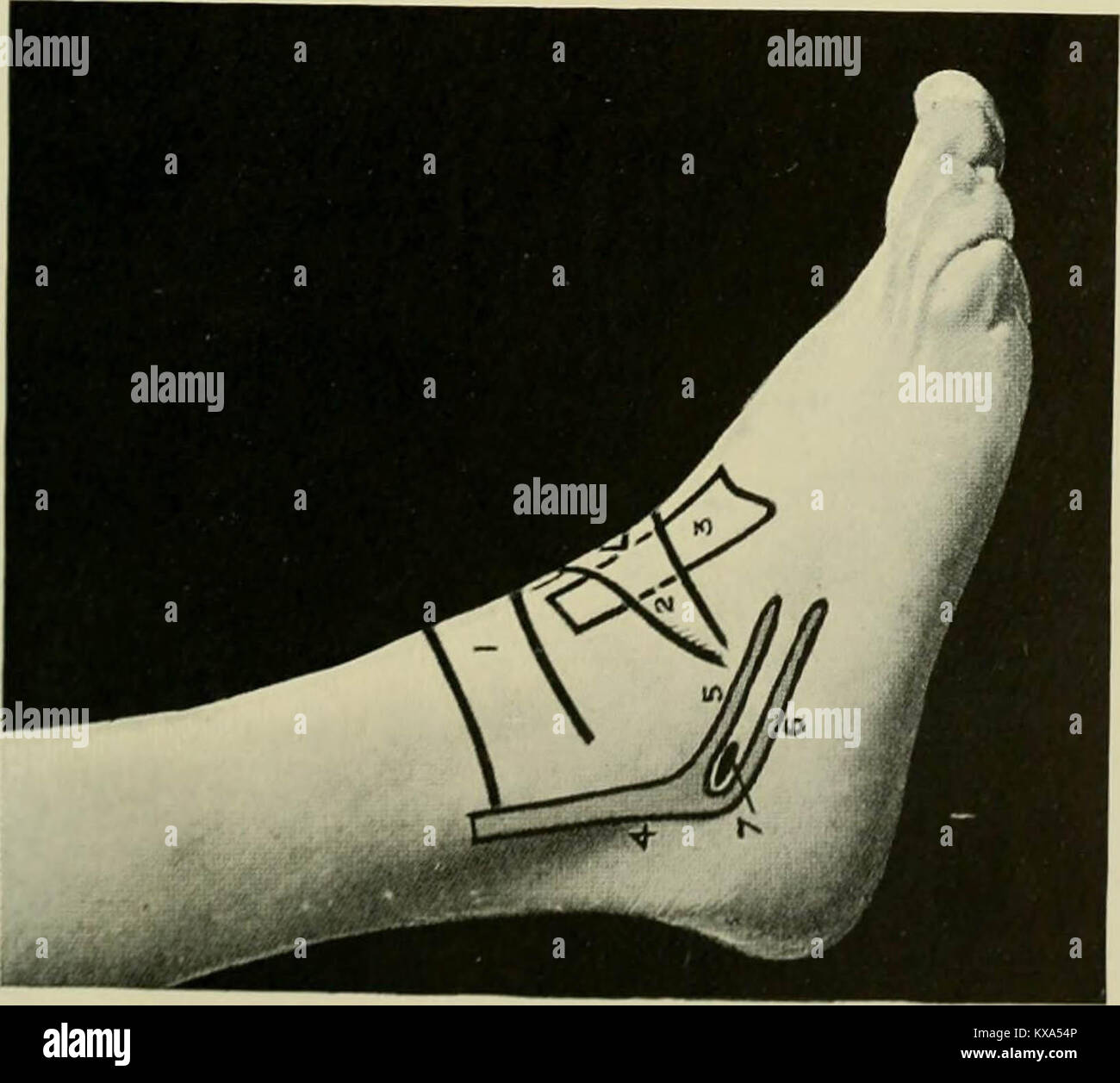 "Landmarks and surface markings of the human body" (1913 Stock Photo ...