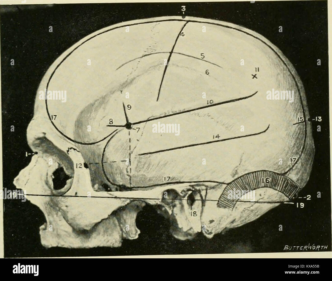 "Landmarks and surface markings of the human body" (1913 Stock Photo ...