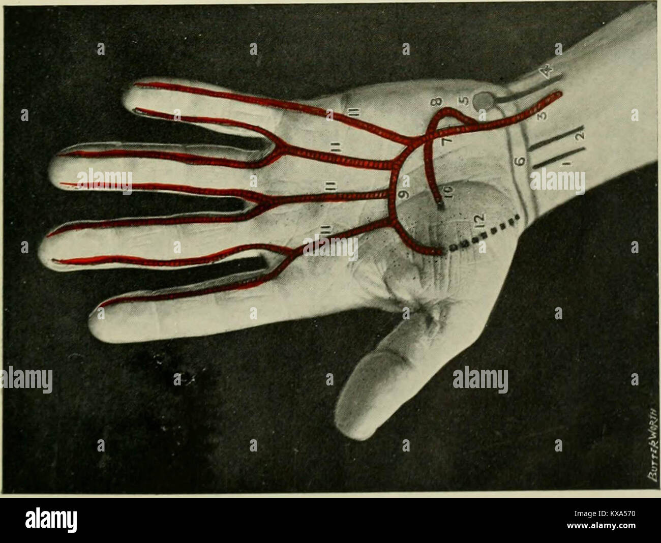 "Landmarks and surface markings of the human body" (1913 Stock Photo ...