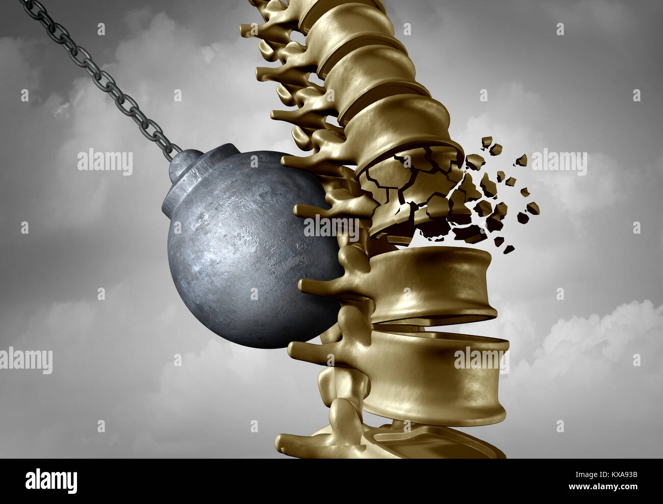 Spine pain and spinal ache and bachache medical disease symbol as a ...